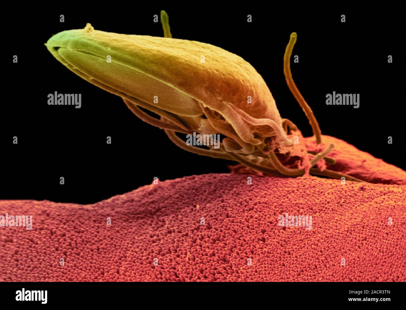Giardia protozoan. Coloured scanning electron micrograph (SEM) of a ...