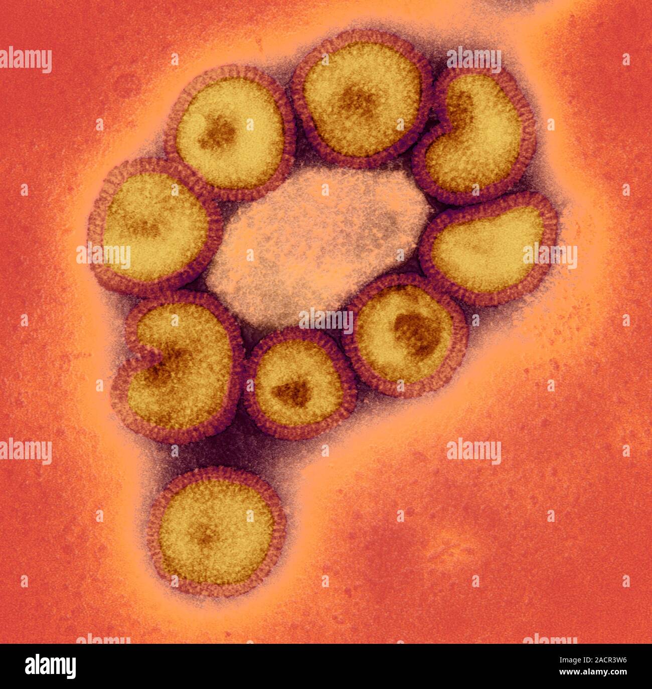 Influenza virus particles. Transmission electron micrograph (TEM) of ...