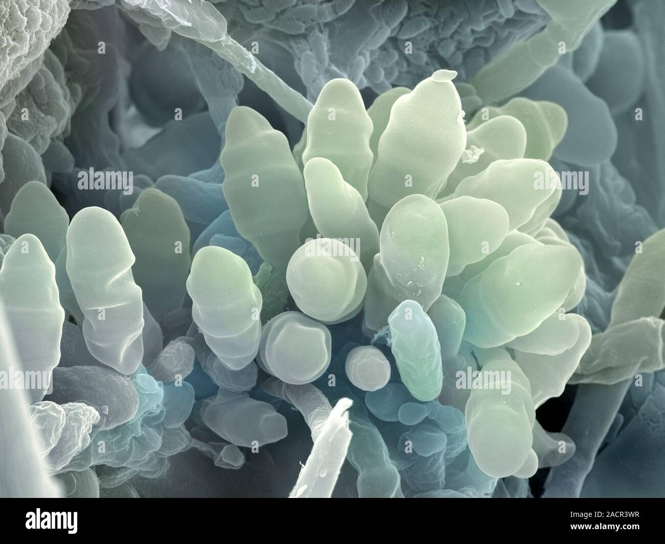 Apple tree fungus. Coloured scanning electron micrograph (SEM) of ...