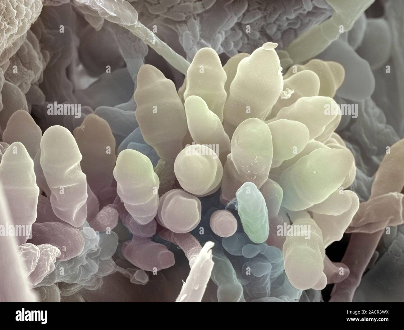 Apple tree fungus. Coloured scanning electron micrograph (SEM) of ...