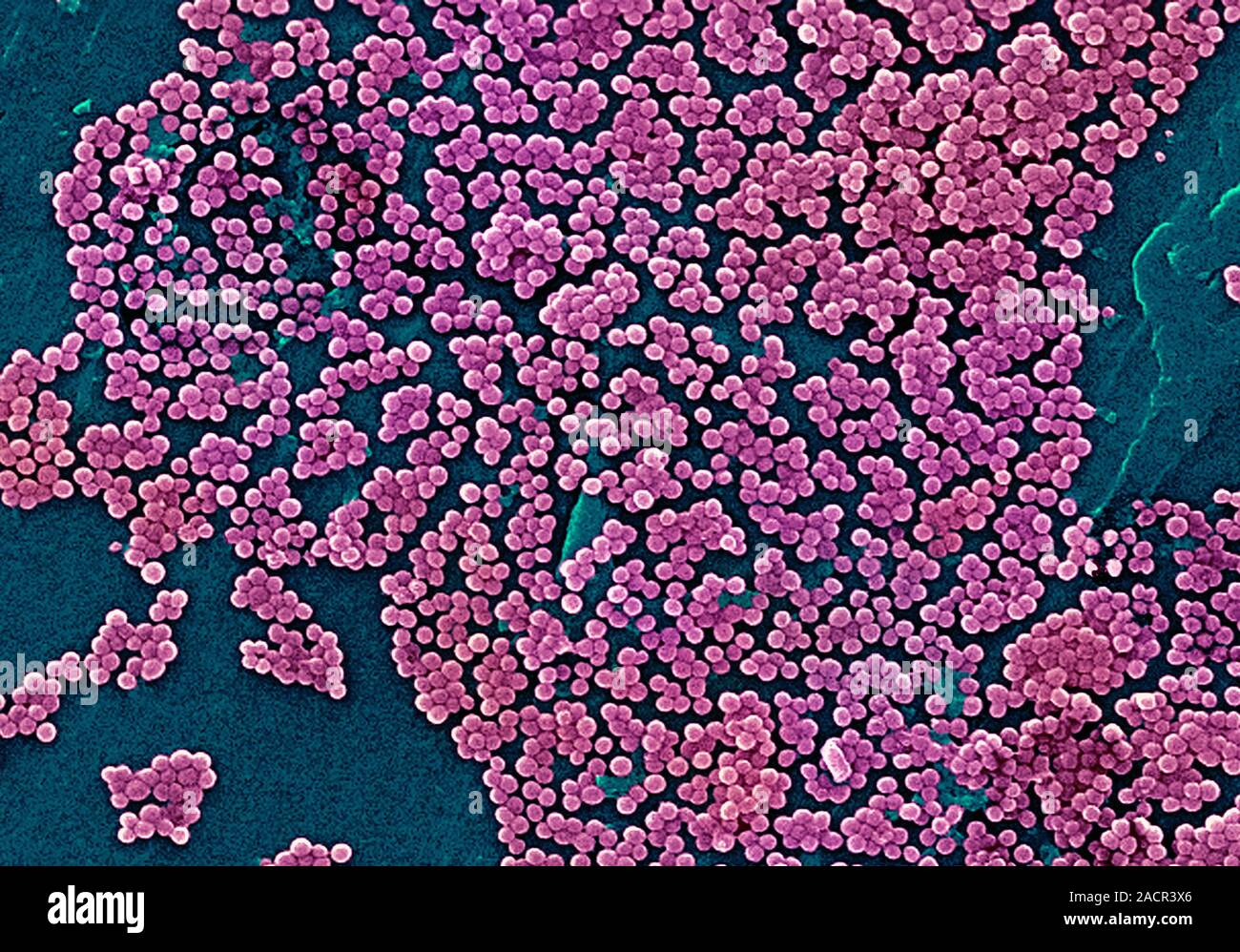 MRSA bacteria. Coloured scanning electron micrograph (SEM) of ... MRSA bacteria. Coloured scanning electron micrograph (SEM) of ...