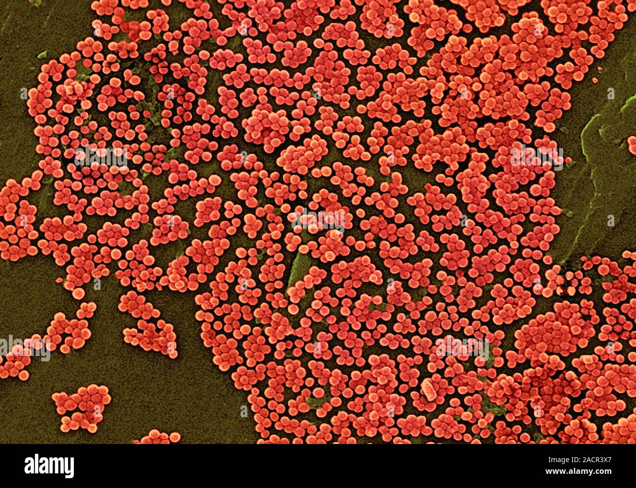 MRSA bacteria. Coloured scanning electron micrograph (SEM) of ...