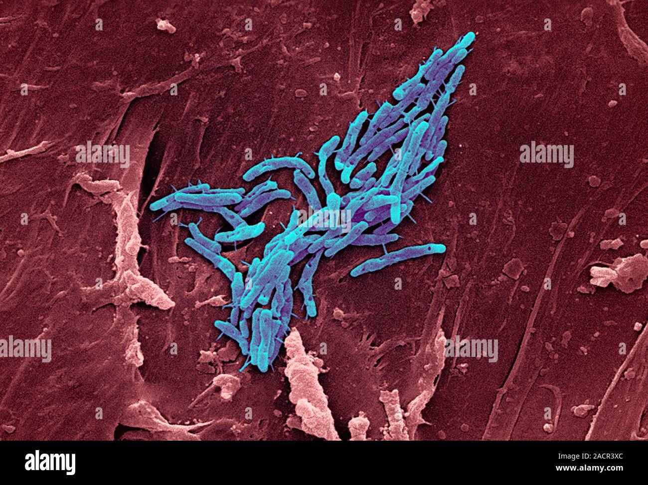 Mycobacterium fortuitum bacteria, coloured scanning electron micrograph (SEM). These bacteria ...