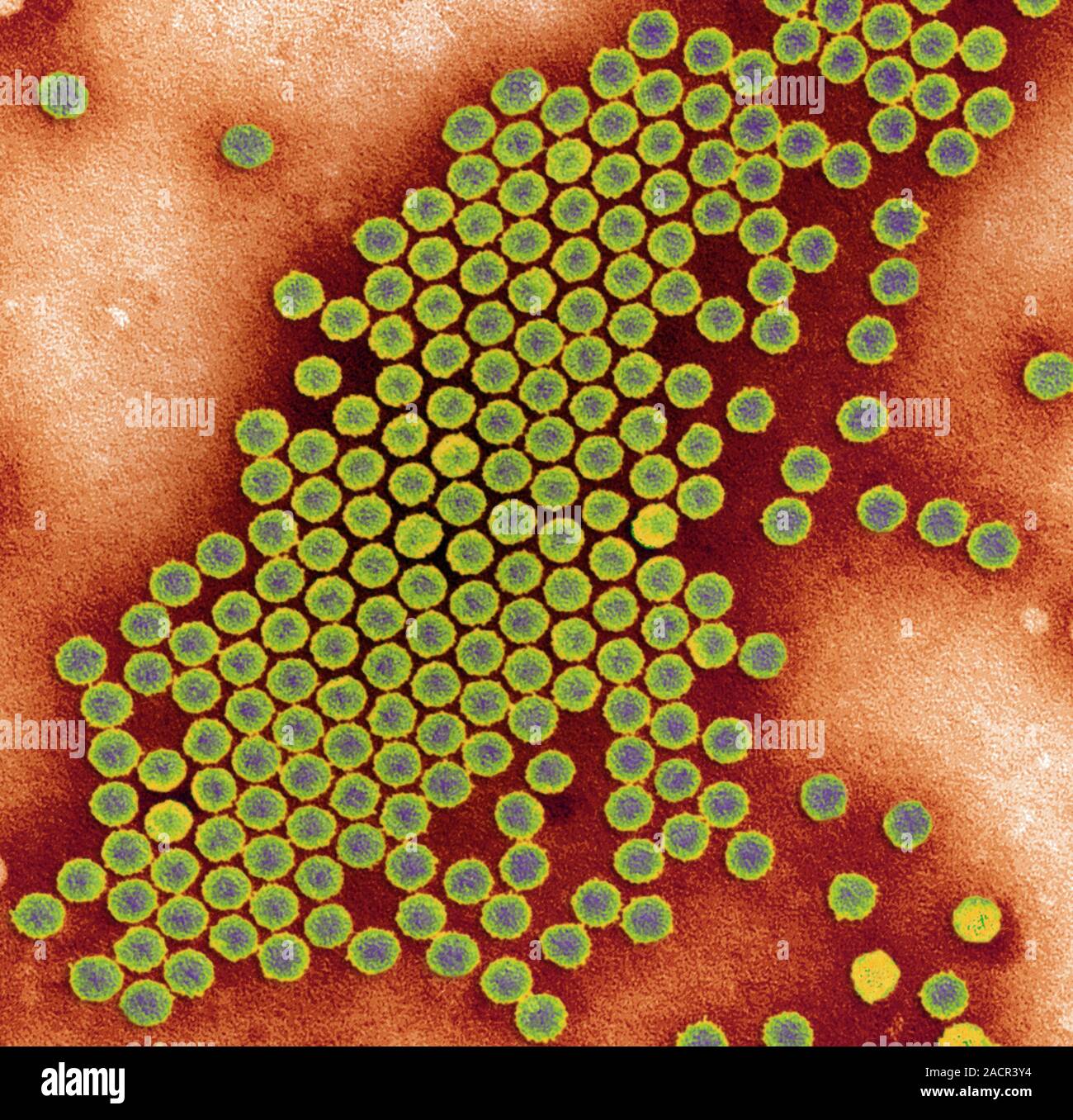 Poliovirus particles. Coloured transmission electron micrograph (TEM ...