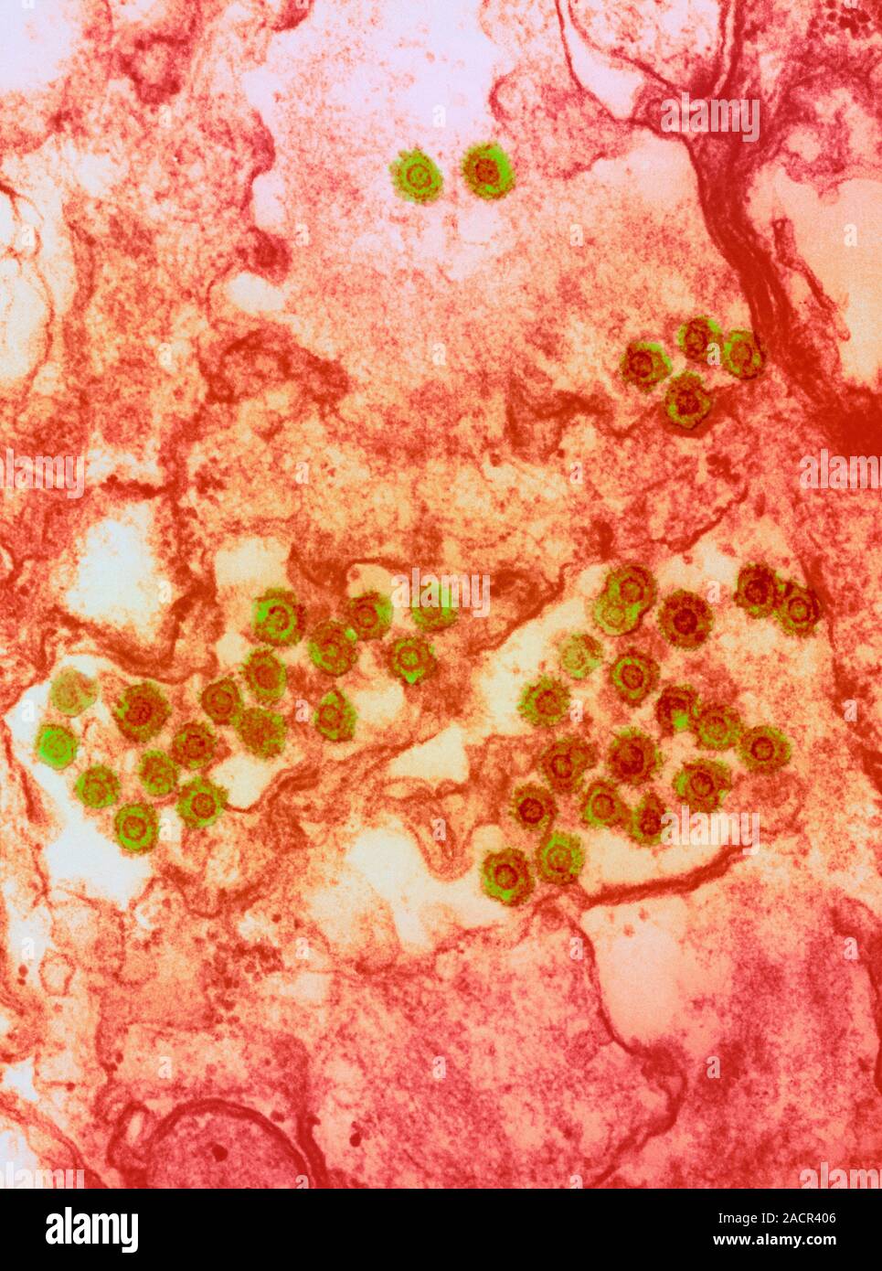 Spumavirus virus particles. Coloured transmission electron micrograph ...