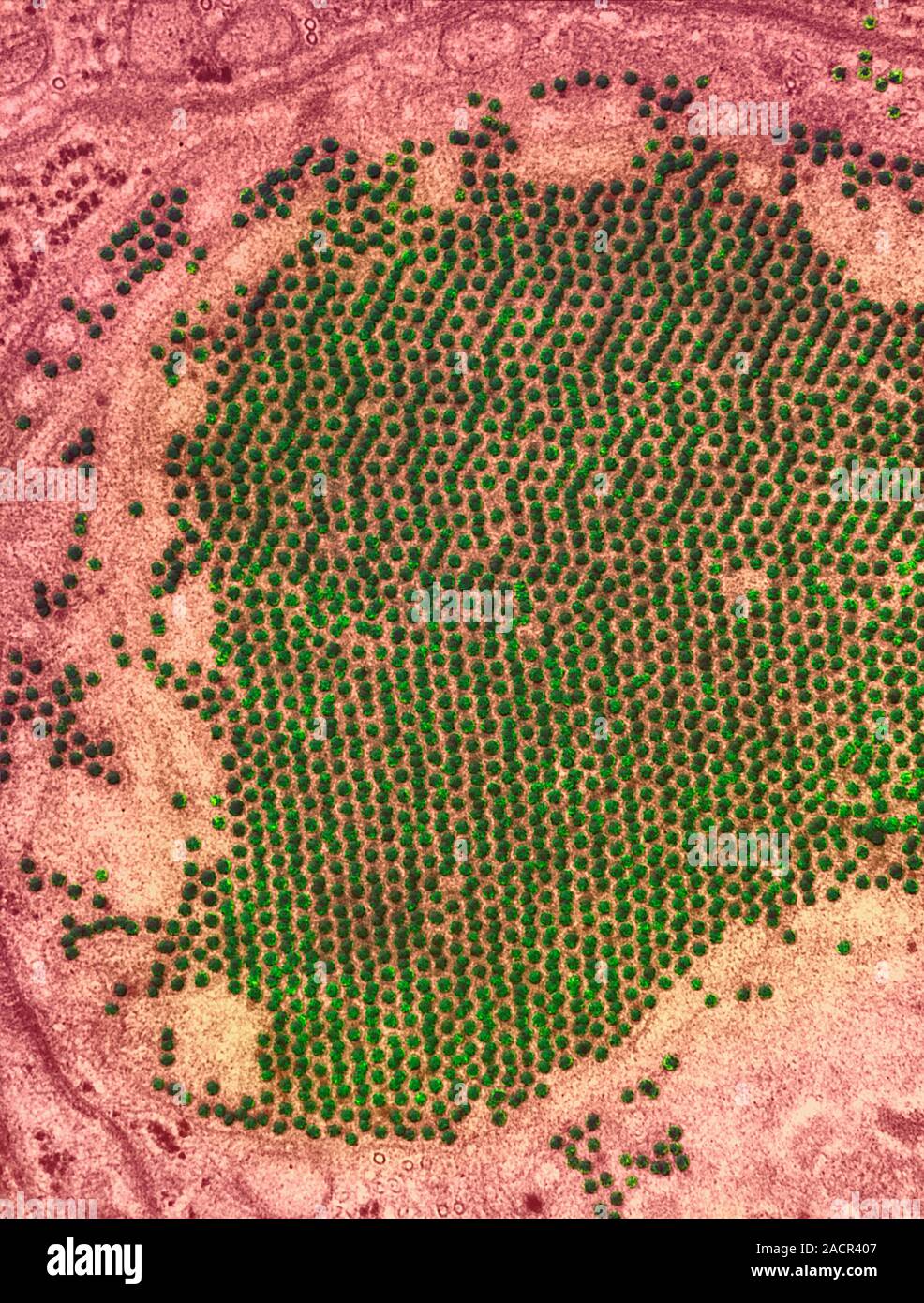 St. Louis encephalitis virus particles. Coloured transmission electron ...