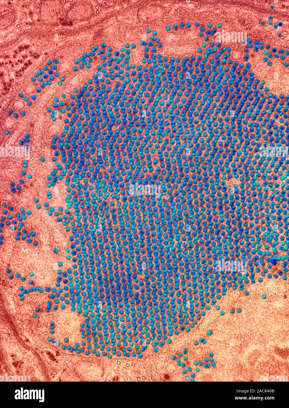 St. Louis encephalitis virus particles. Coloured transmission electron ...