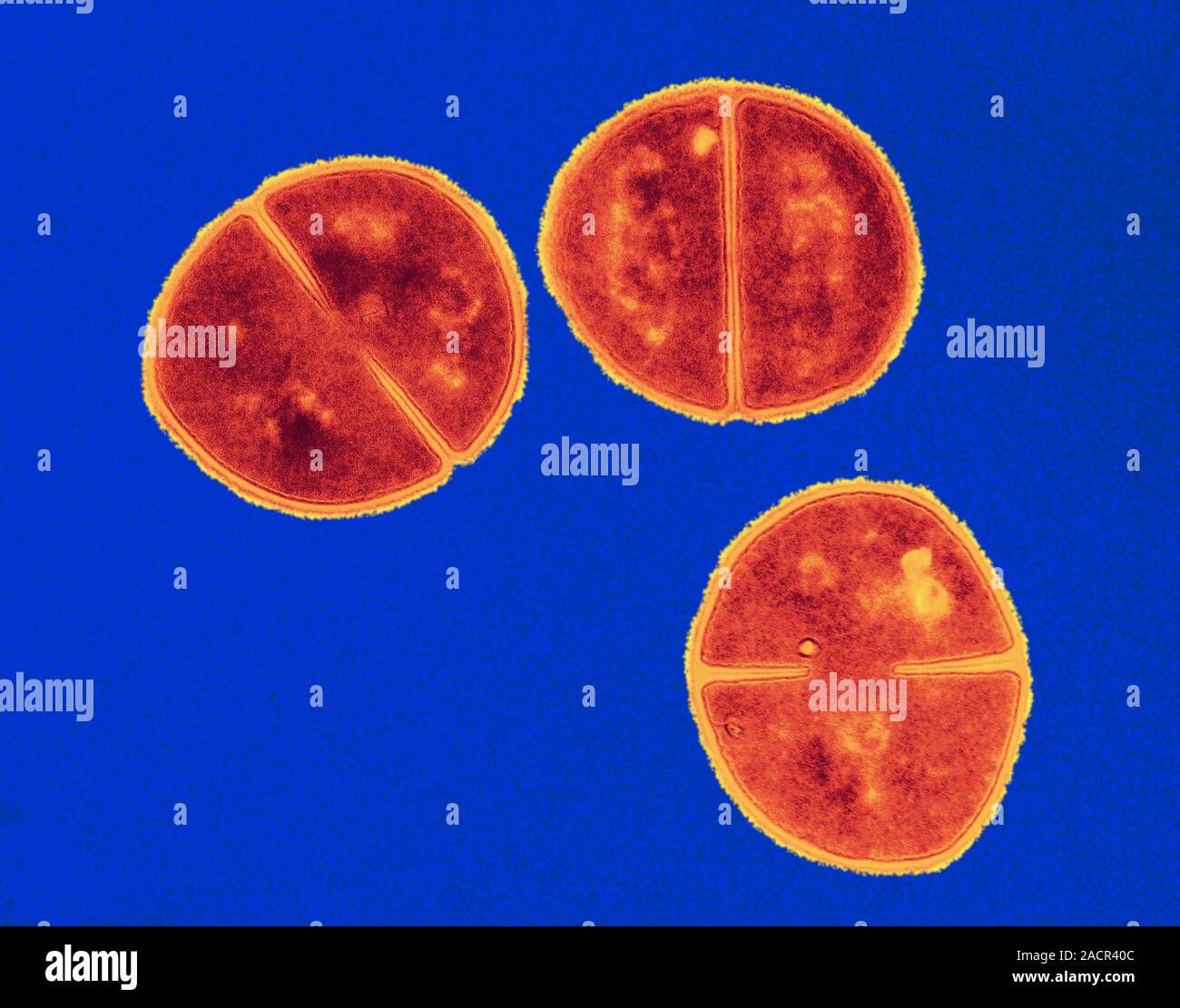 Staphylococcus aureus bacteria. Coloured transmission electron ... Staphylococcus aureus bacteria. Coloured transmission electron ...