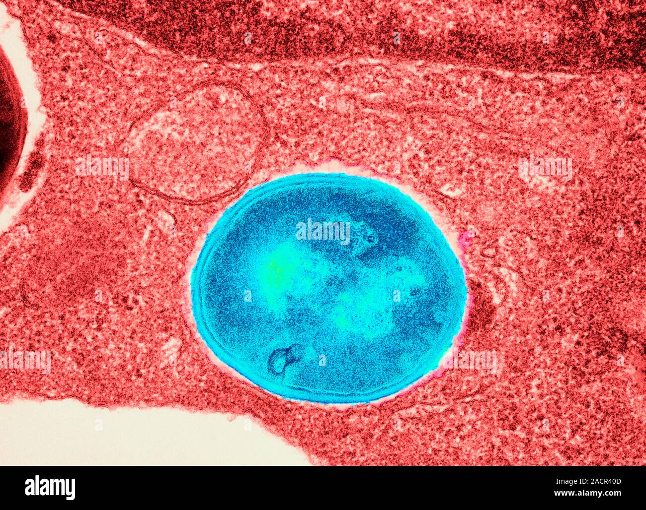 Staphylococcus aureus bacteria. Coloured transmission electron ... Staphylococcus aureus bacteria. Coloured transmission electron ...