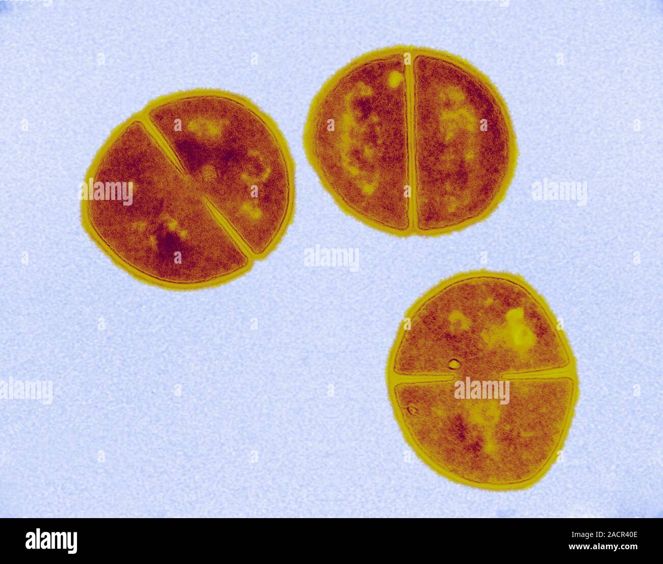 Staphylococcus aureus bacteria. Coloured transmission electron ... Staphylococcus aureus bacteria. Coloured transmission electron ...
