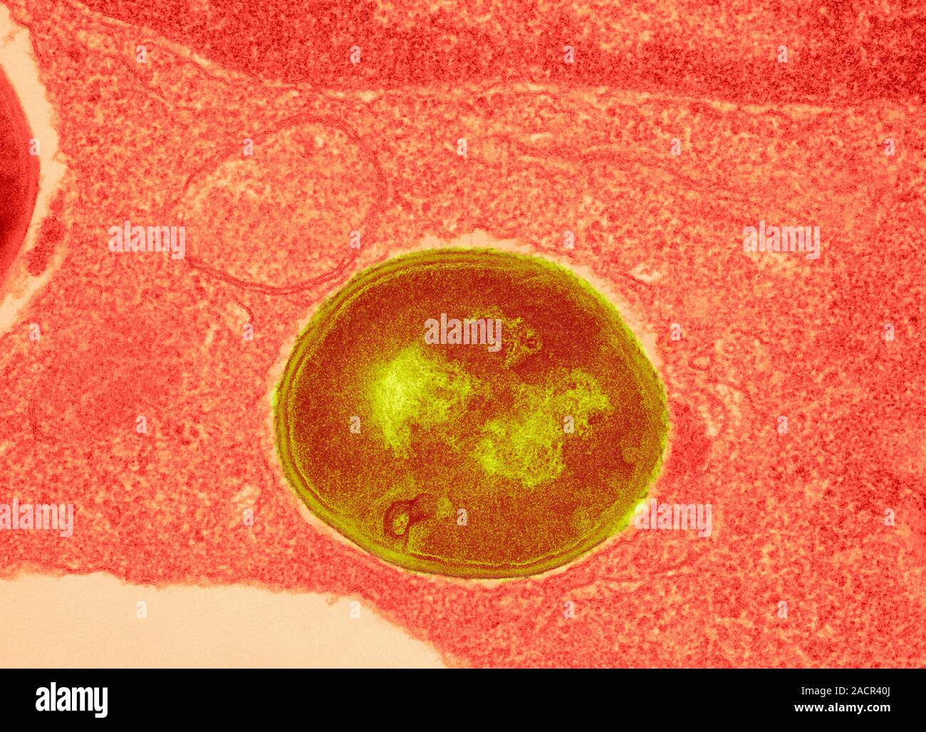 Staphylococcus aureus bacteria. Coloured transmission electron ...