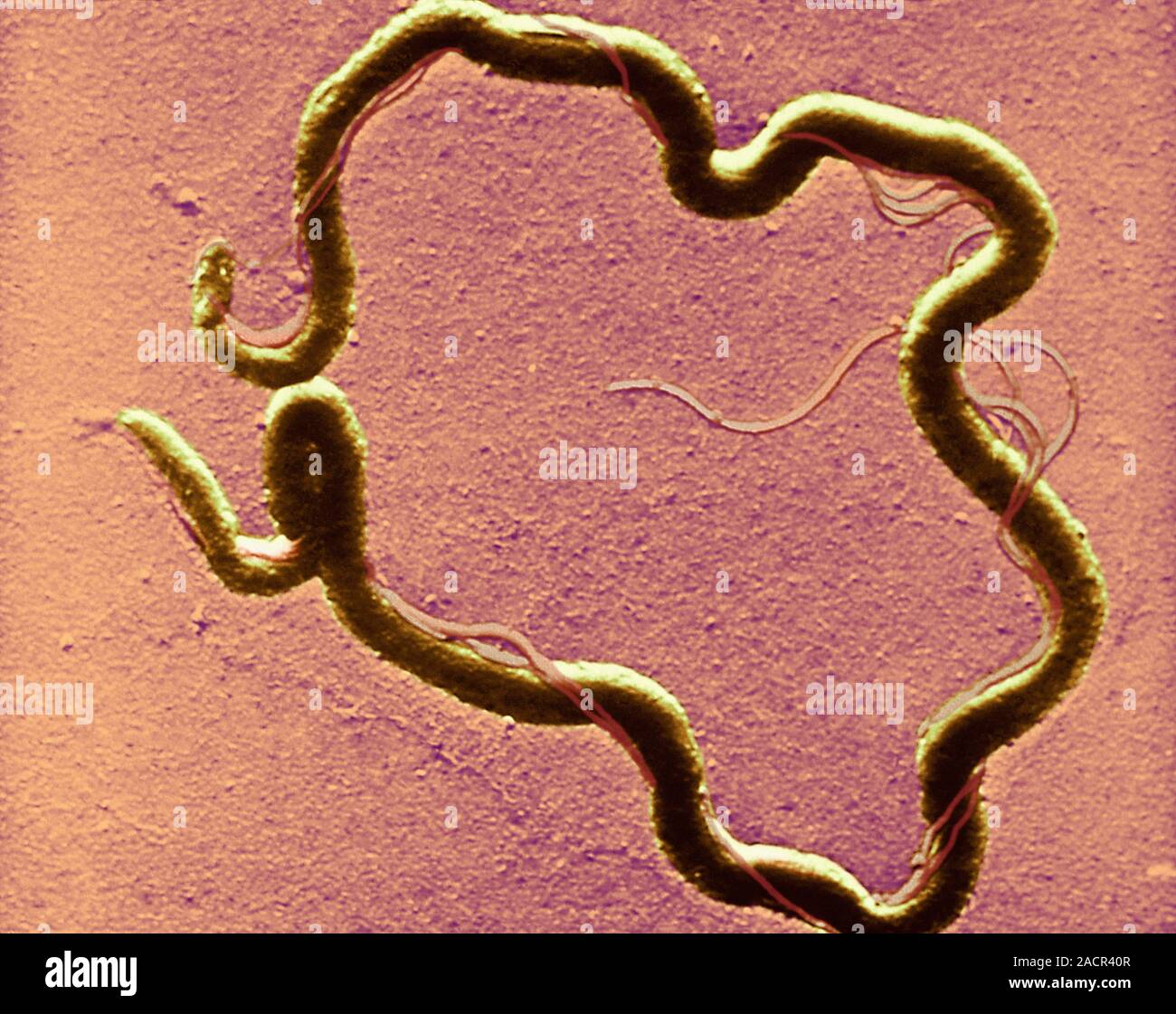 Syphilis bacteria. Transmission electron micrograph (TEM) of a ...