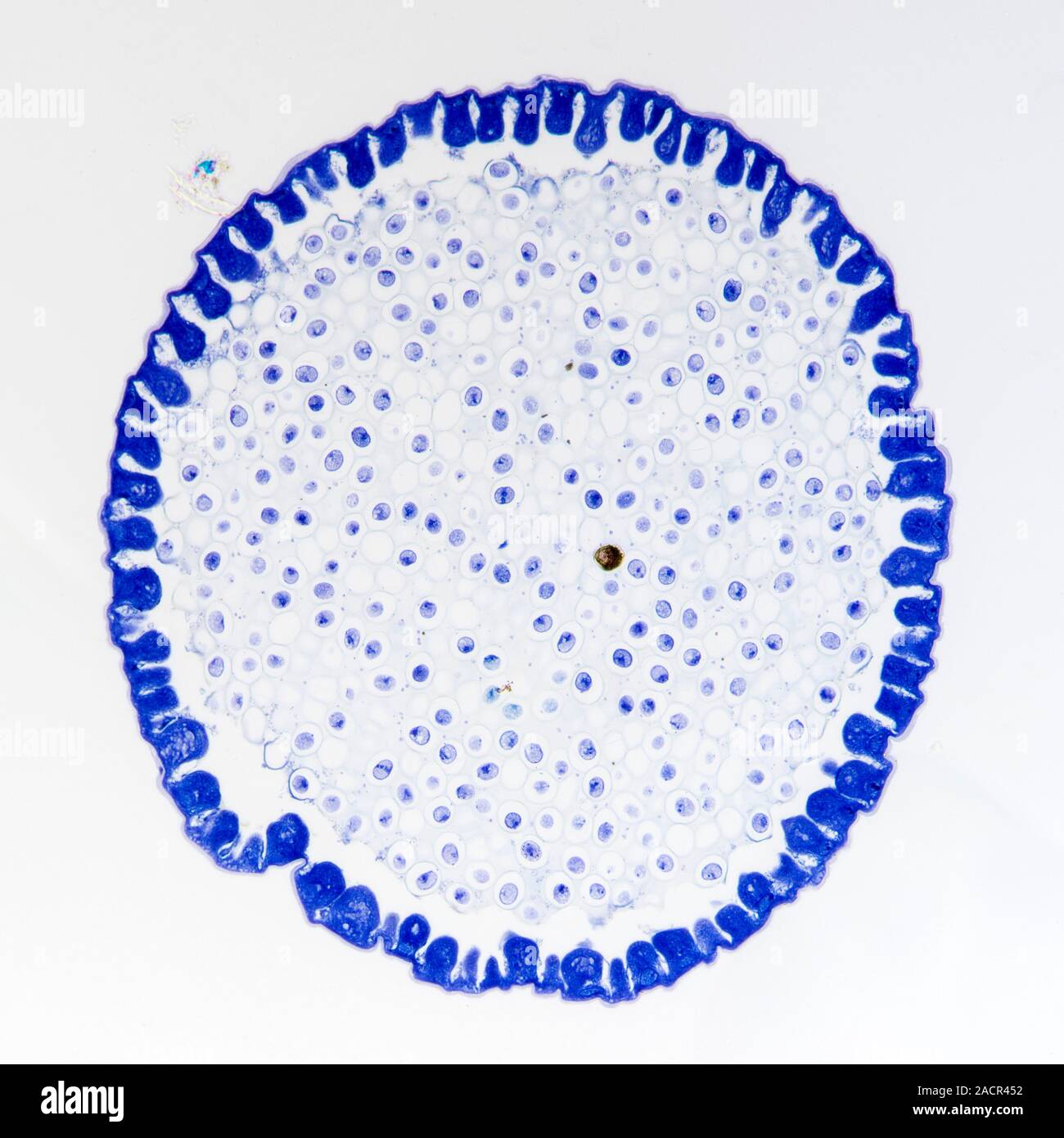 Roundworm germ cells. Light micrograph of germ cells from a roundworm ...