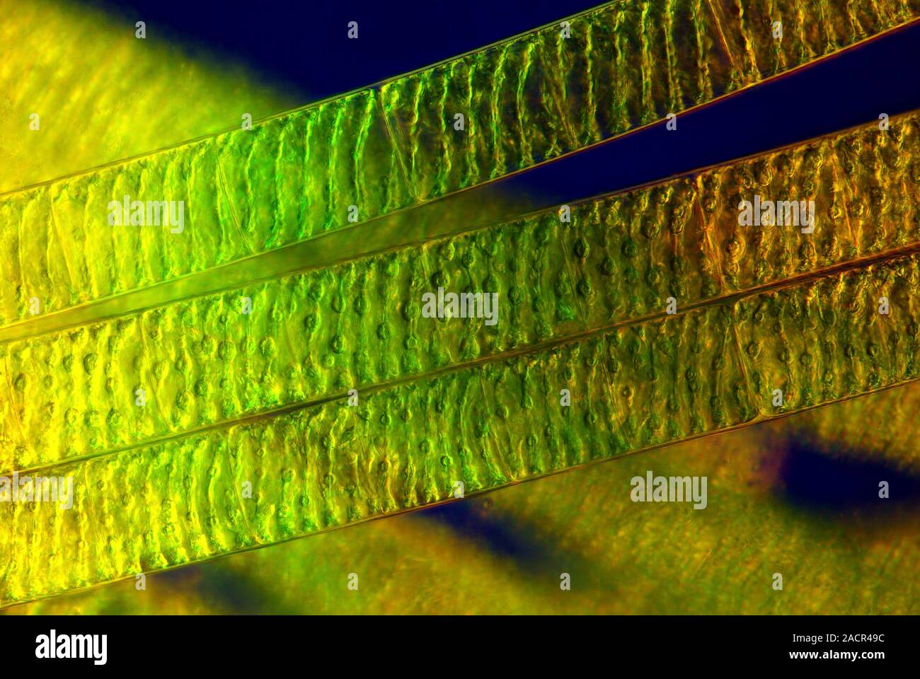 Spirogyra algae. Rheinberg illuminated light micrograph of Spirogyra sp ... Spirogyra algae. Rheinberg illuminated light micrograph of Spirogyra sp ...