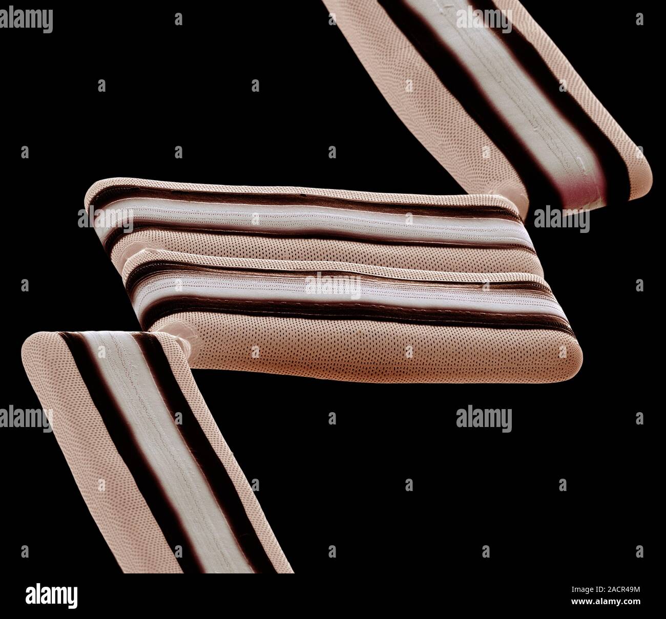 Tabellaria diatoms. Coloured scanning electron micrograph (SEM) of a ...