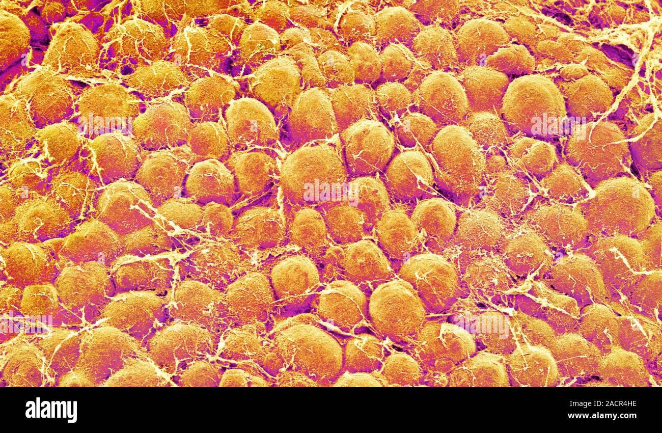 Fat tissue. Coloured scanning electron micrograph (SEM) of fat cells ...