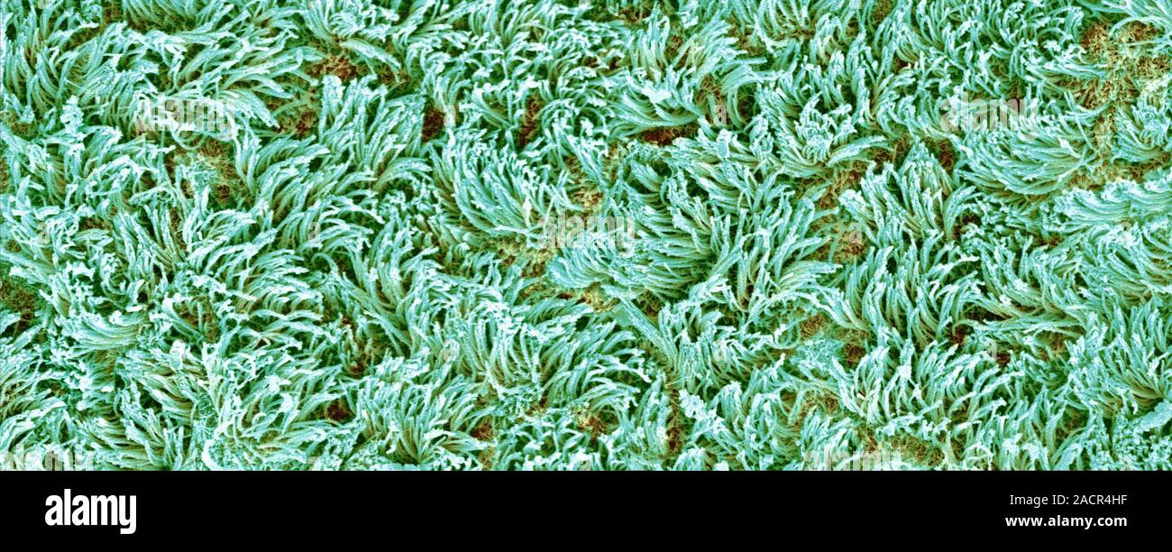 Trachea lining. Coloured scanning electron micrograph (SEM) of the ...