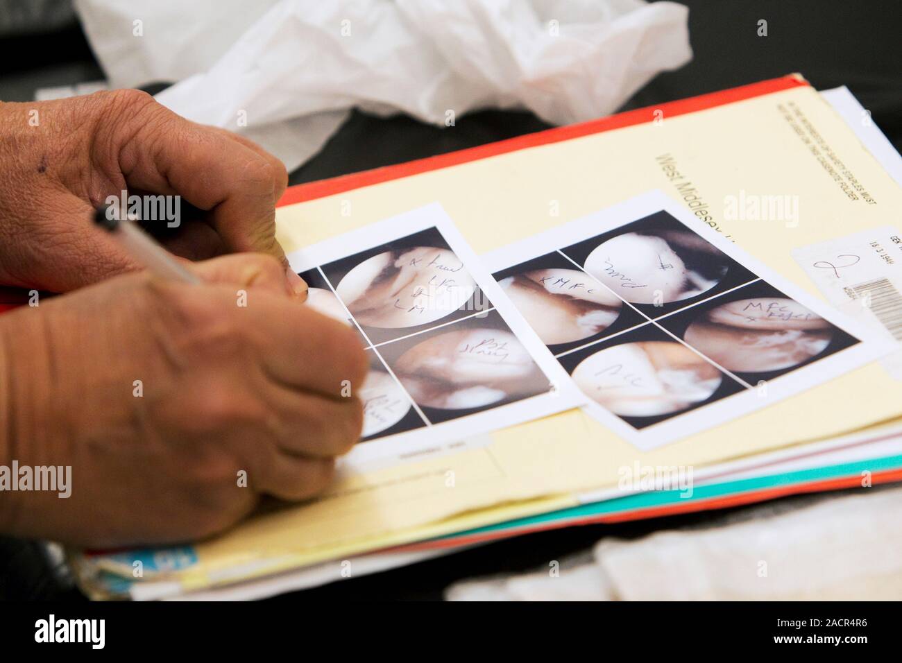 Surgeon writing notes on endoscopic images of a patient's knee Stock ...