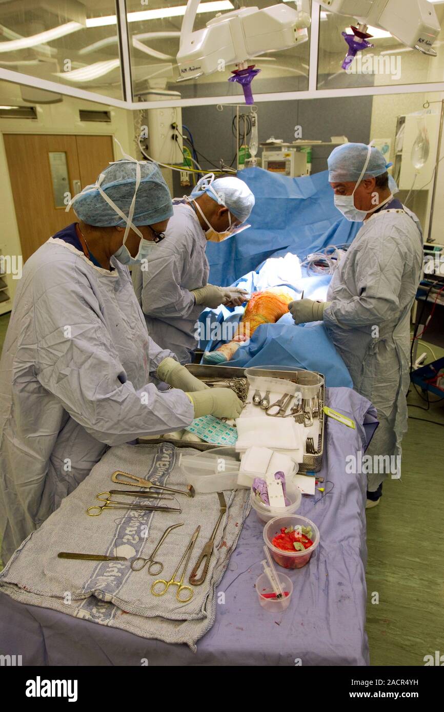 Knee replacement surgery. Surgical team performing a total knee ...