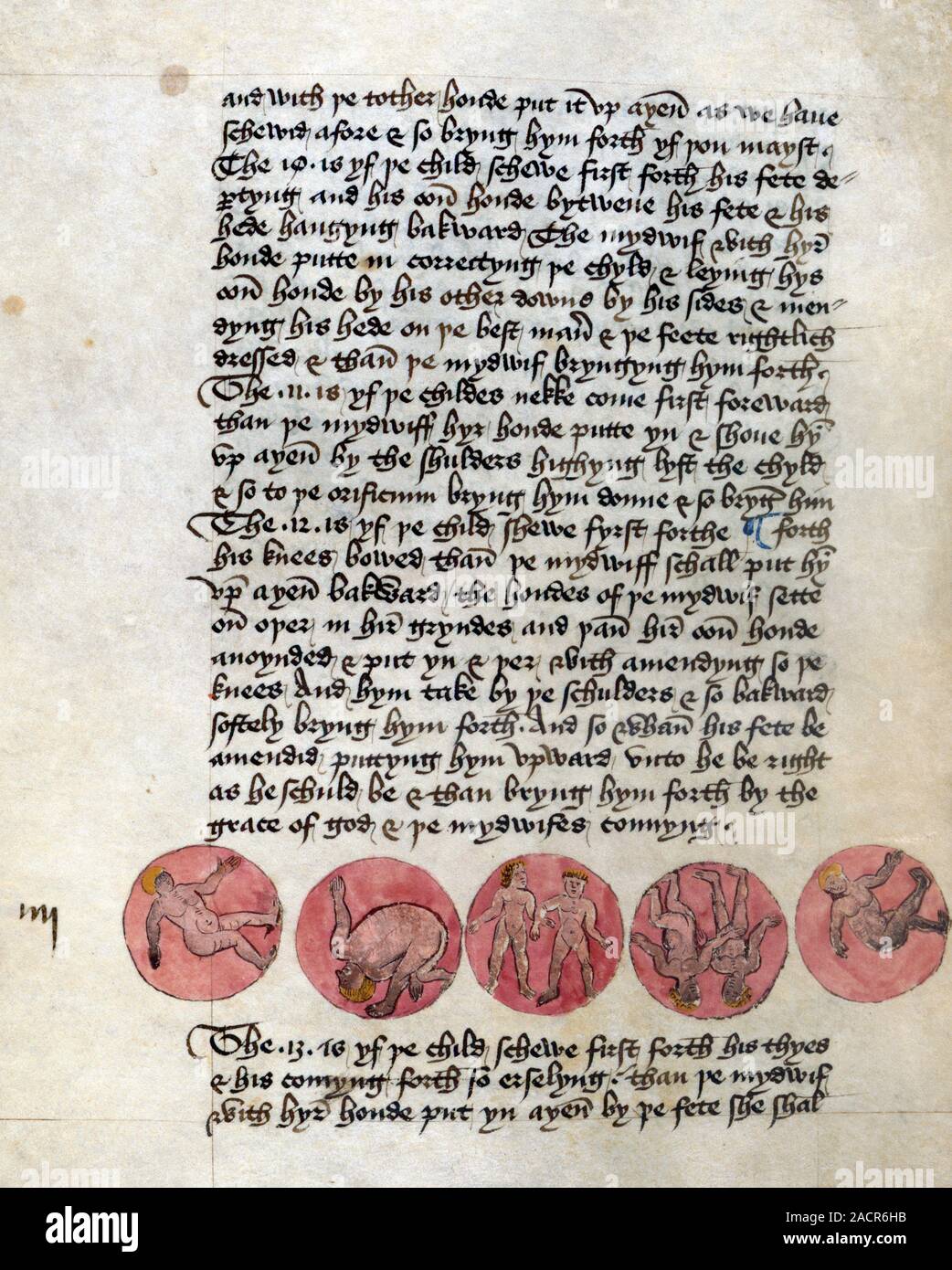 Foetal presentations. Five roundels (from a series of seventeen) showing foetuses in the womb ...