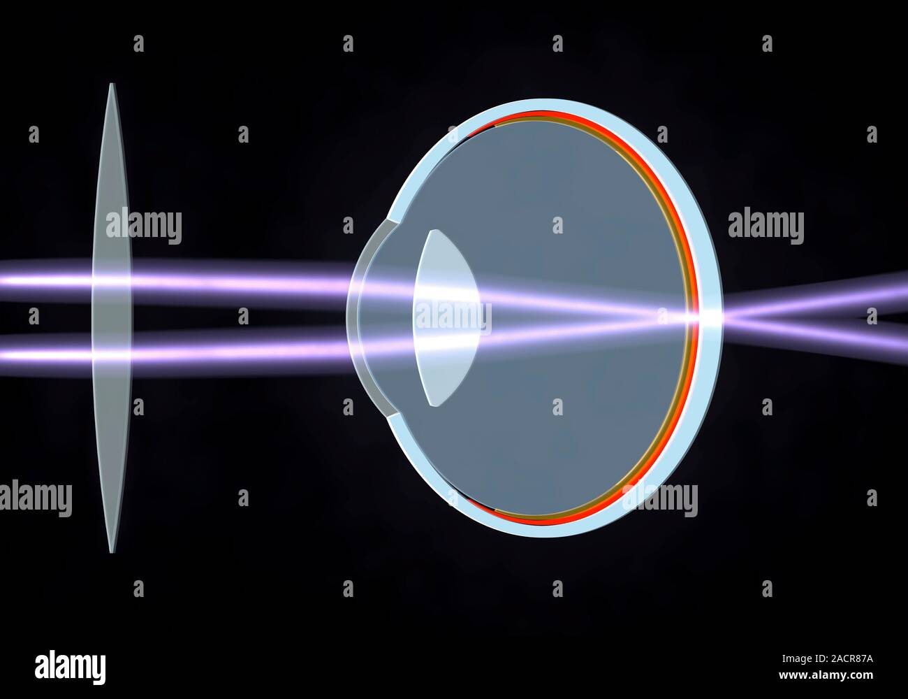 This image may not be used in educational posters Correction of long ...