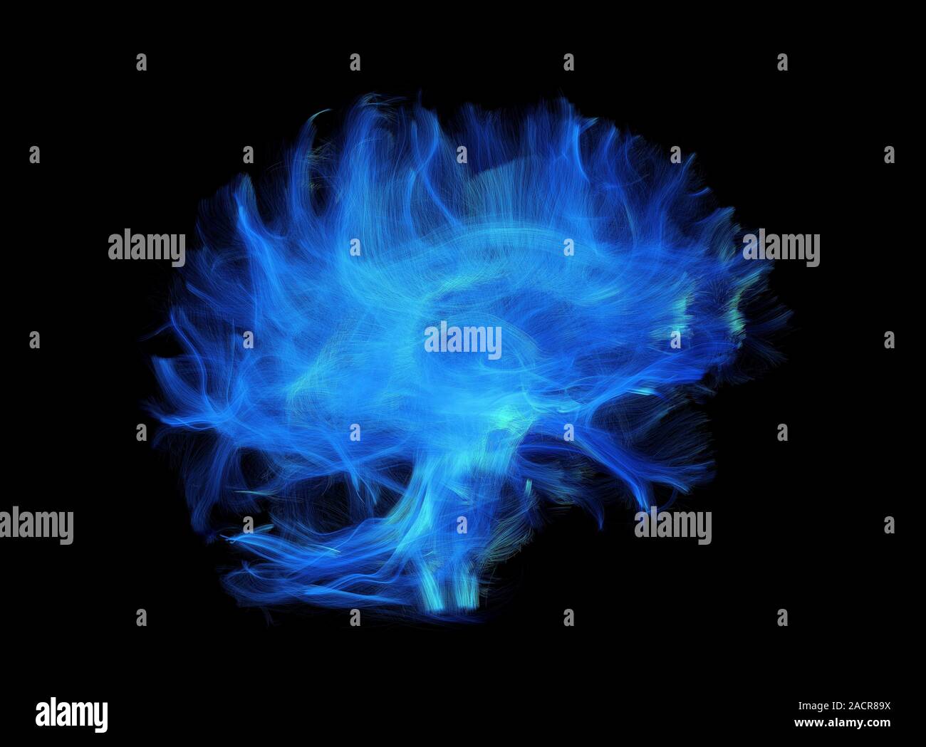 Brain fibres. 3D diffusion tensor imaging (DTI) magnetic resonance ...