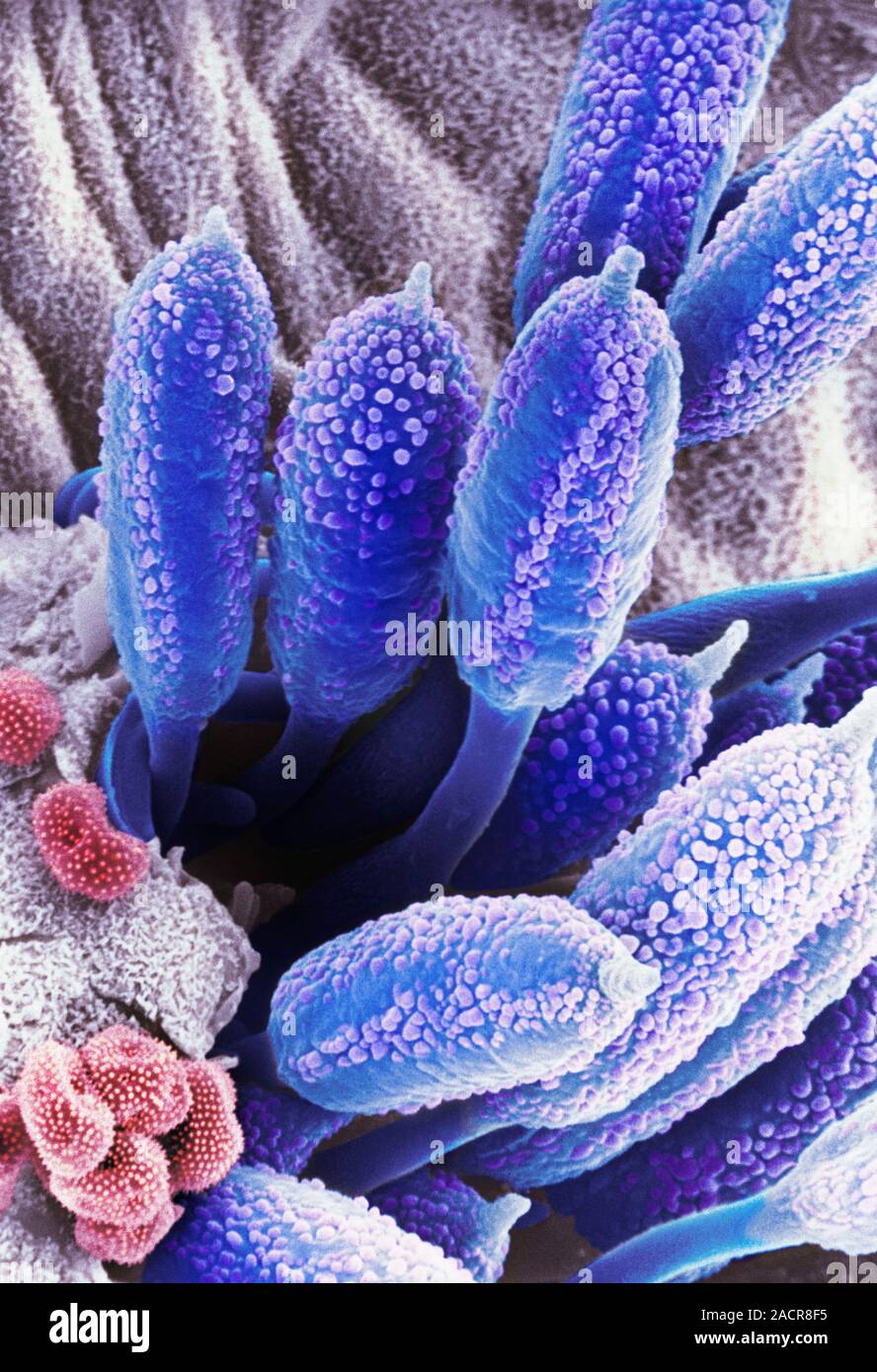 Rust fungus on a rose leaf. Coloured scanning electron micrograph (SEM ...