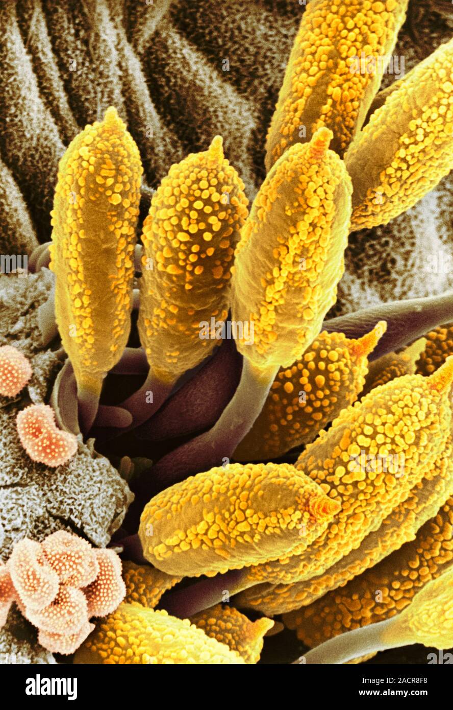 Rust fungus on a rose leaf. Coloured scanning electron micrograph (SEM ...