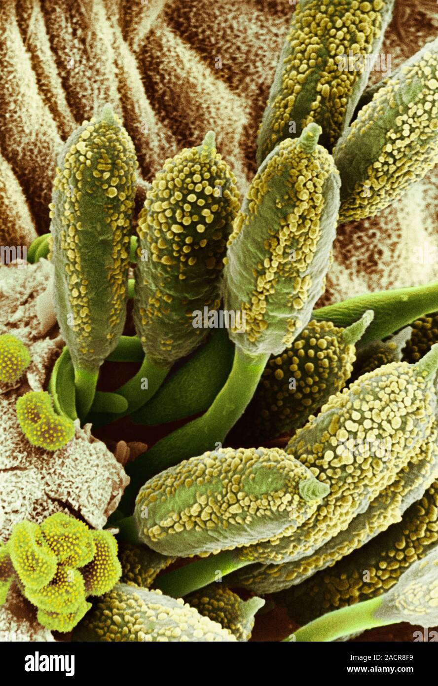 Rust fungus on a rose leaf. Coloured scanning electron micrograph (SEM ...