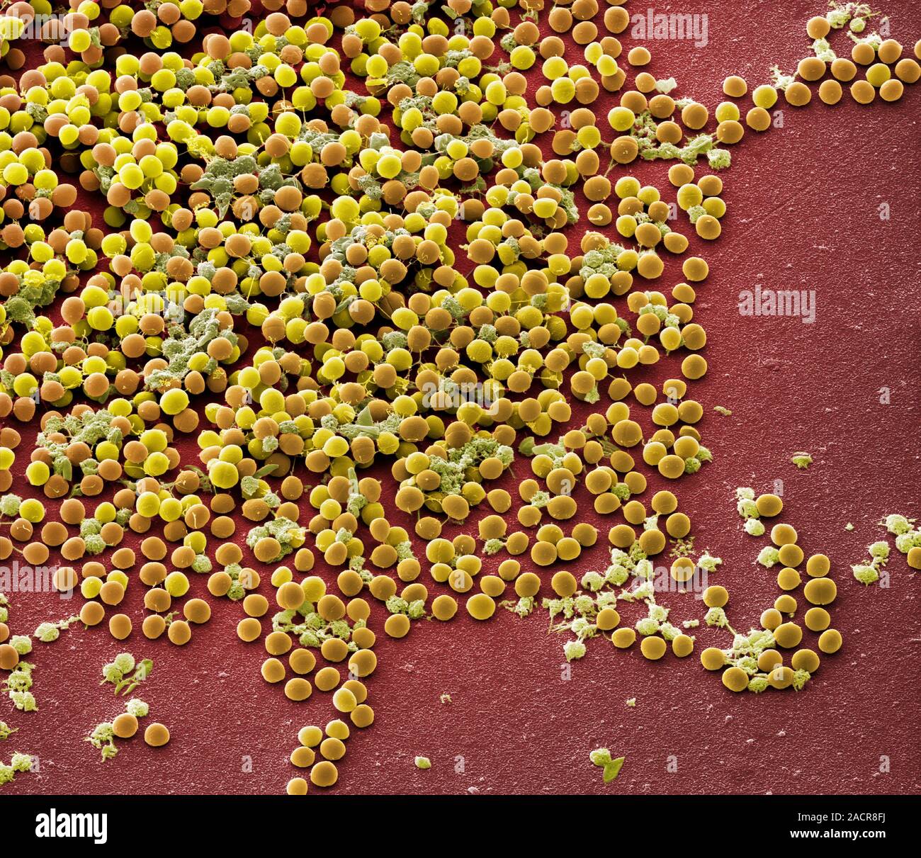 Staphylococcus aureus bacteria, coloured scanning electron micrograph ... Staphylococcus aureus bacteria, coloured scanning electron micrograph ...