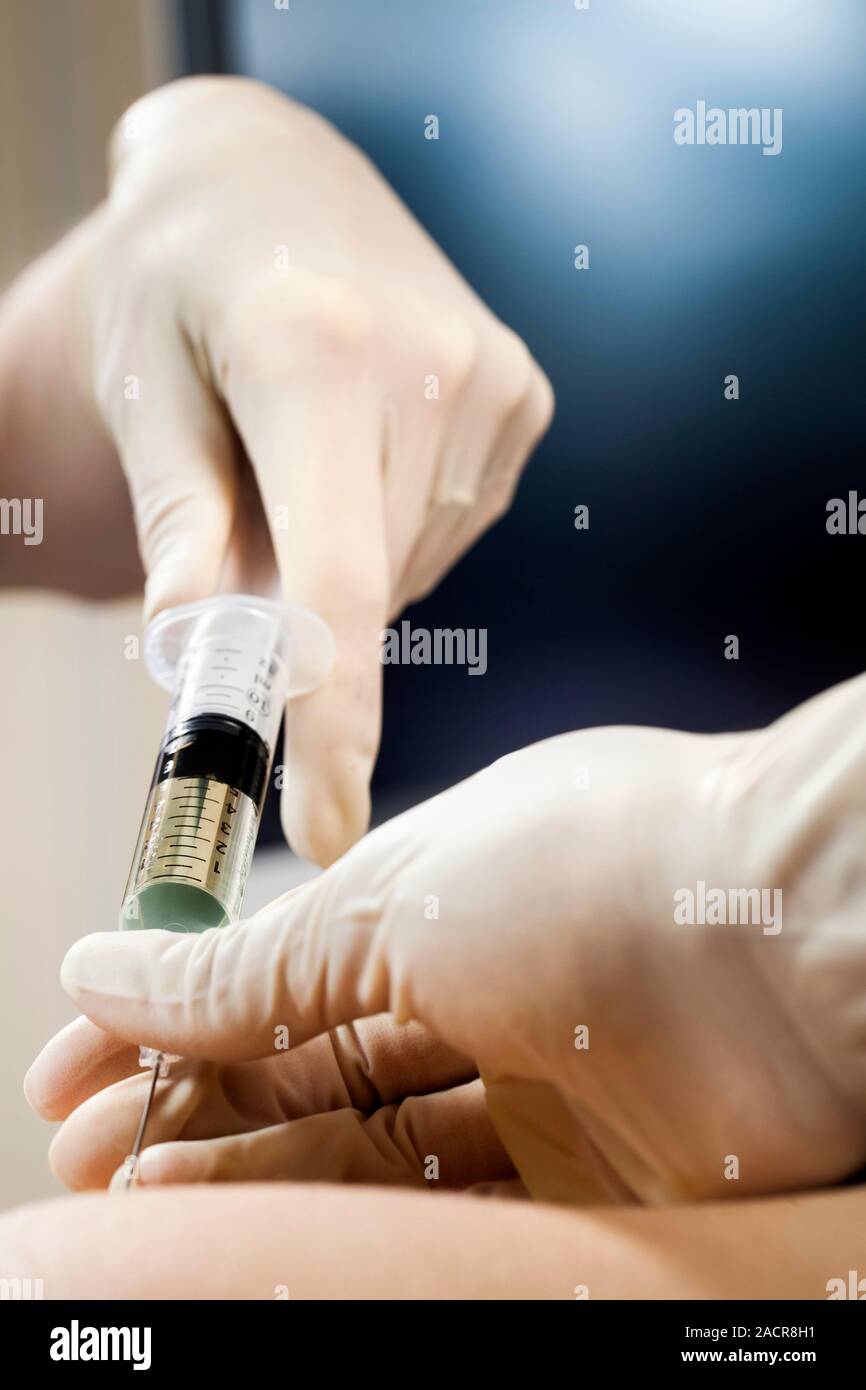 Amniocentesis test in pregnancy. This test is performed on pregnant ...