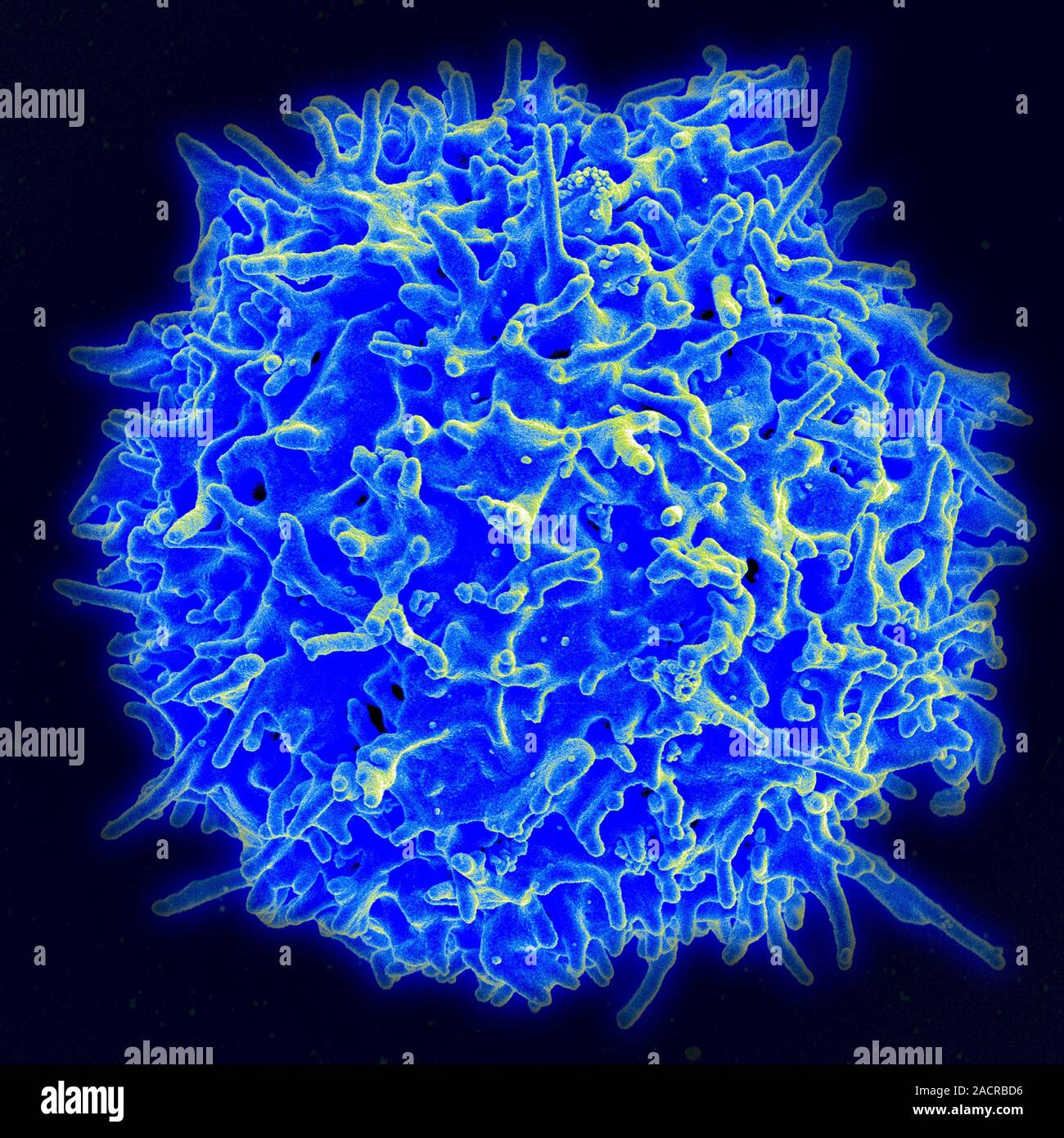 T-Lymphocyte, coloured scanning electron micrograph (SEM). T ...