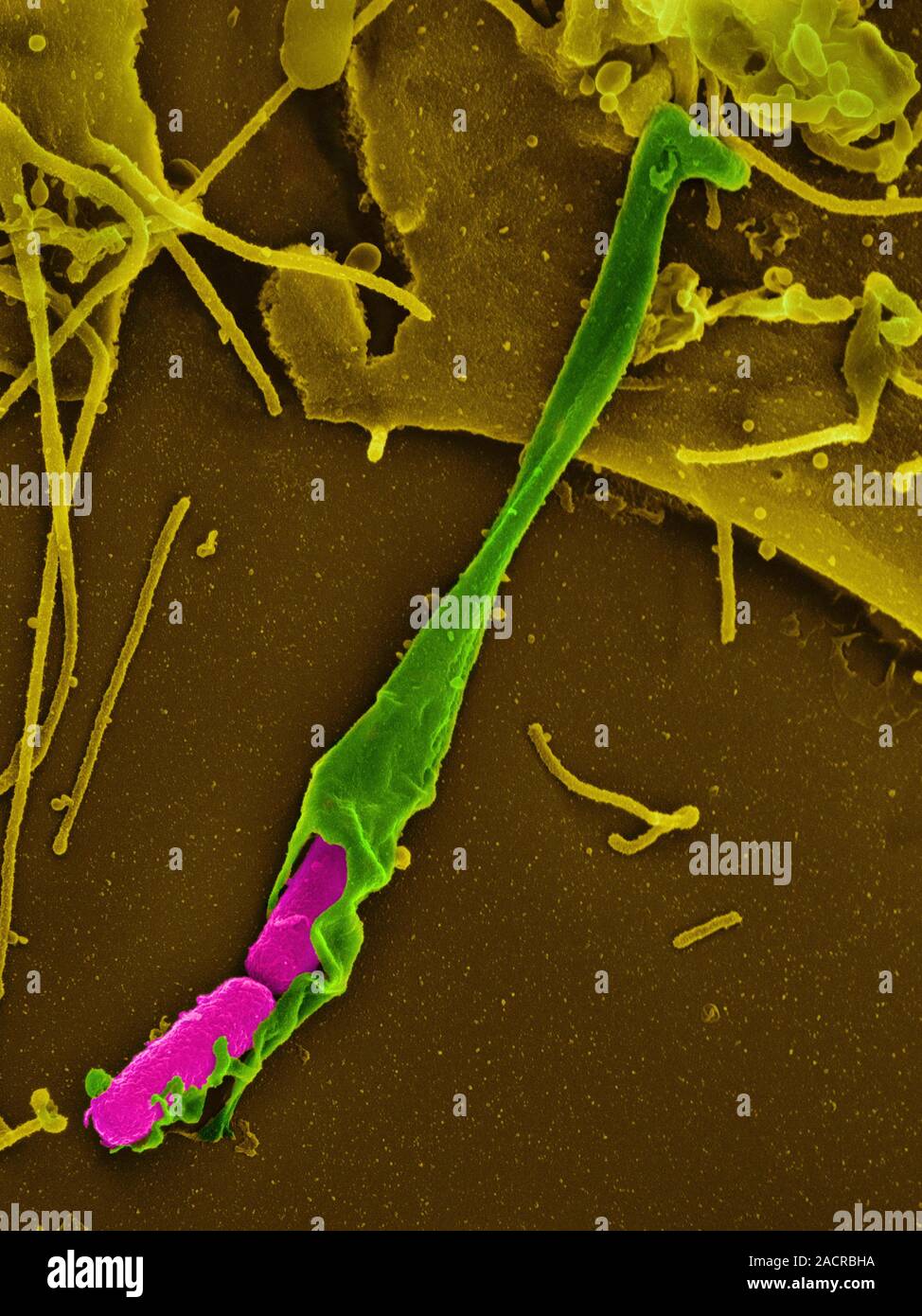 Actin-based motility. Coloured scanning electron micrograph (SEM) of ...