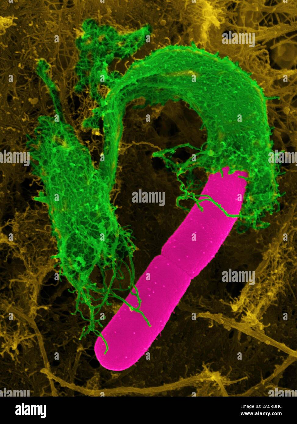 Actin-based motility. Coloured scanning electron micrograph (SEM) of ...