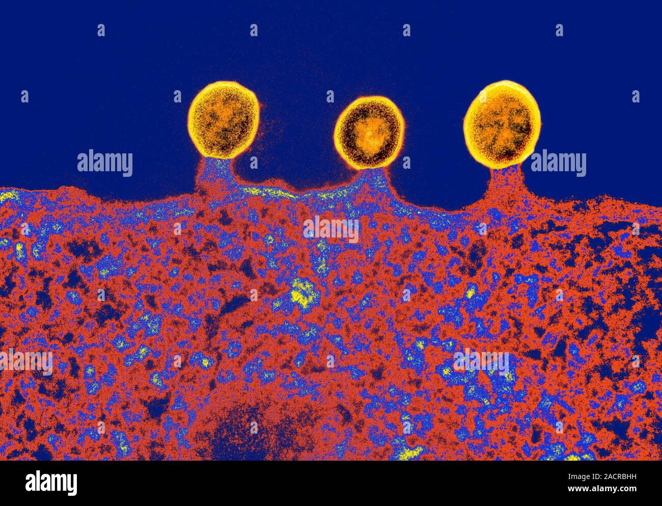 Cell infected with HIV. Coloured transmission electron micrograph (TEM ...