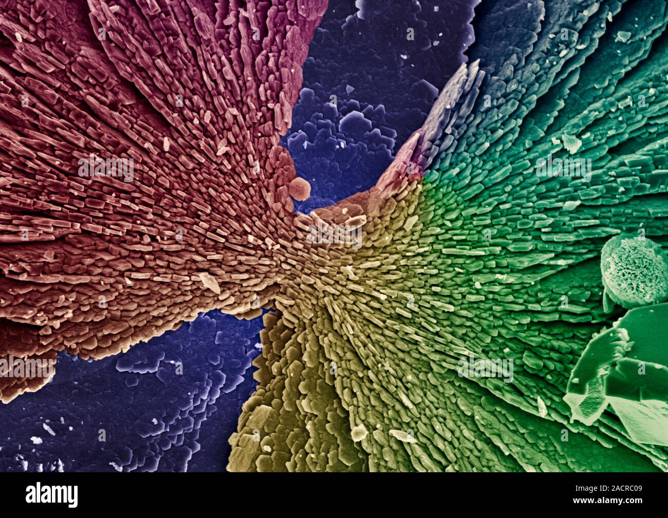 False-coloured Scanning Electron Micrograph (SEM) of microscopic ...