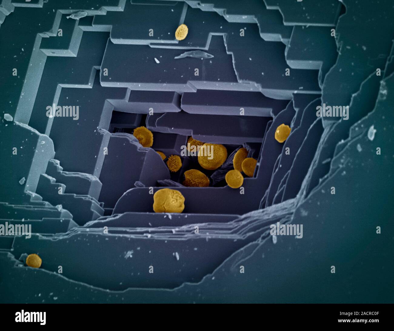 False-coloured Scanning Electron Micrograph (SEM) of microscopic ...