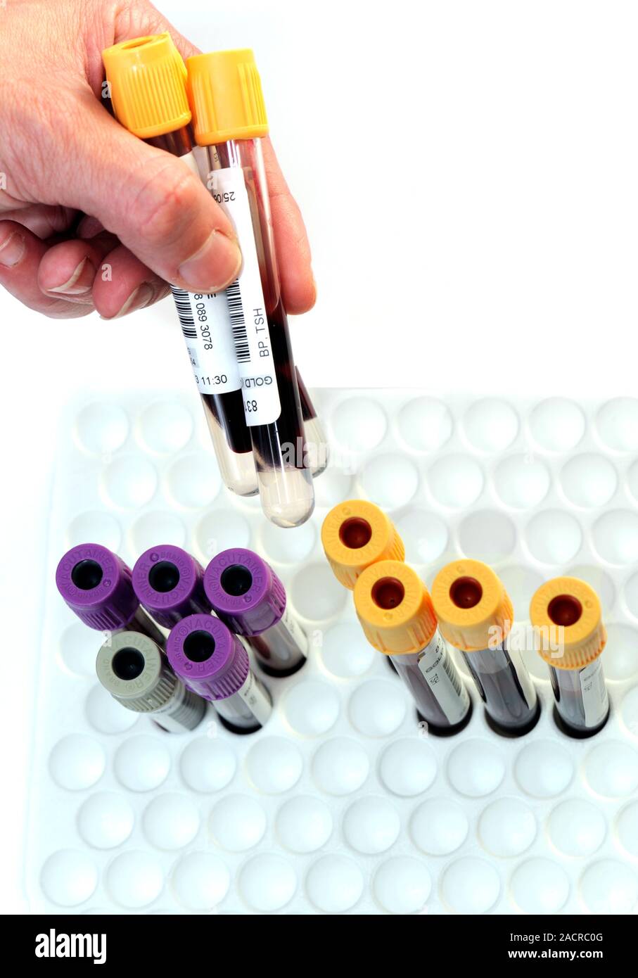 Not for use in Television Blood samples for analysis and diagnostics ...