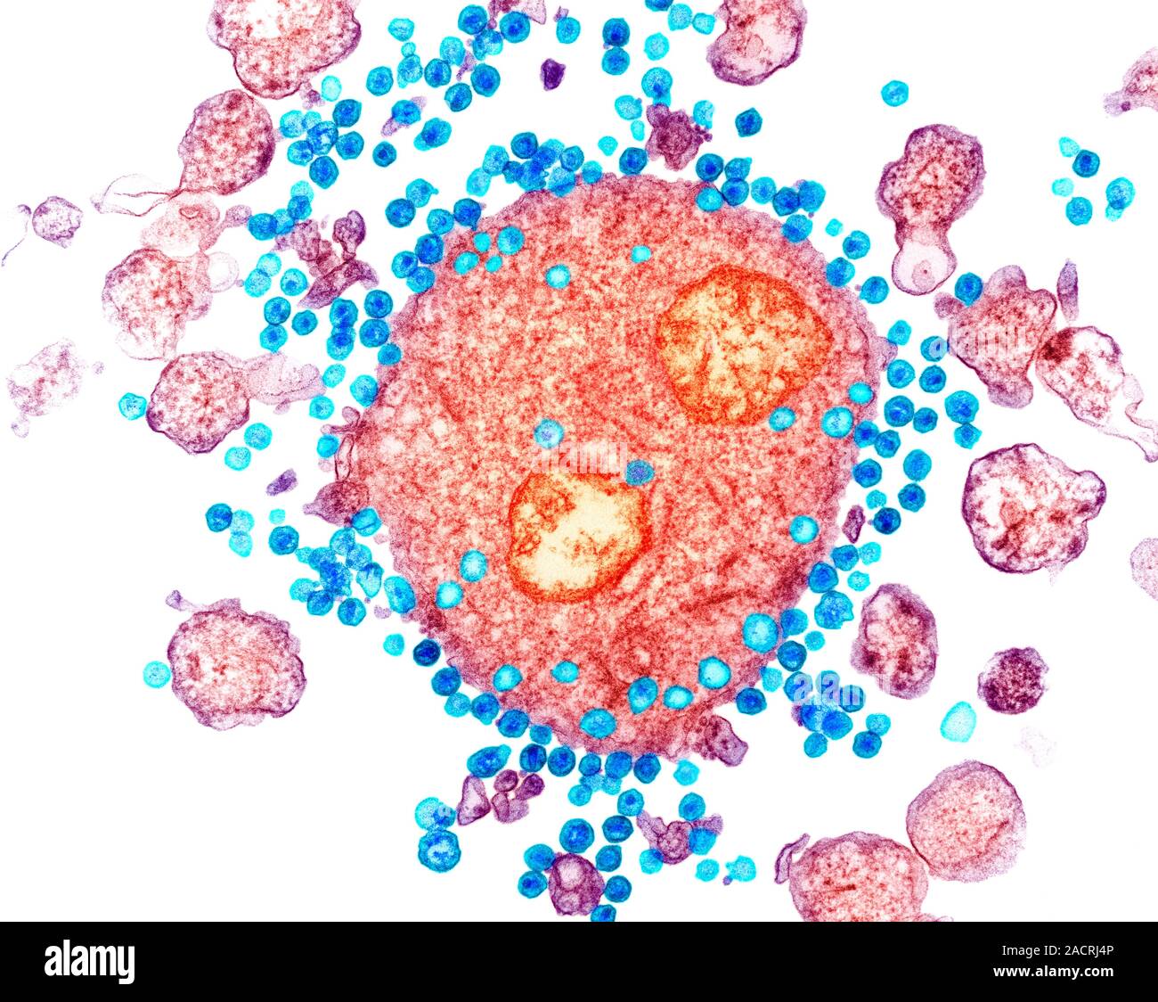 Budding HIV particles. Coloured transmision electron micrograph (TEM ...