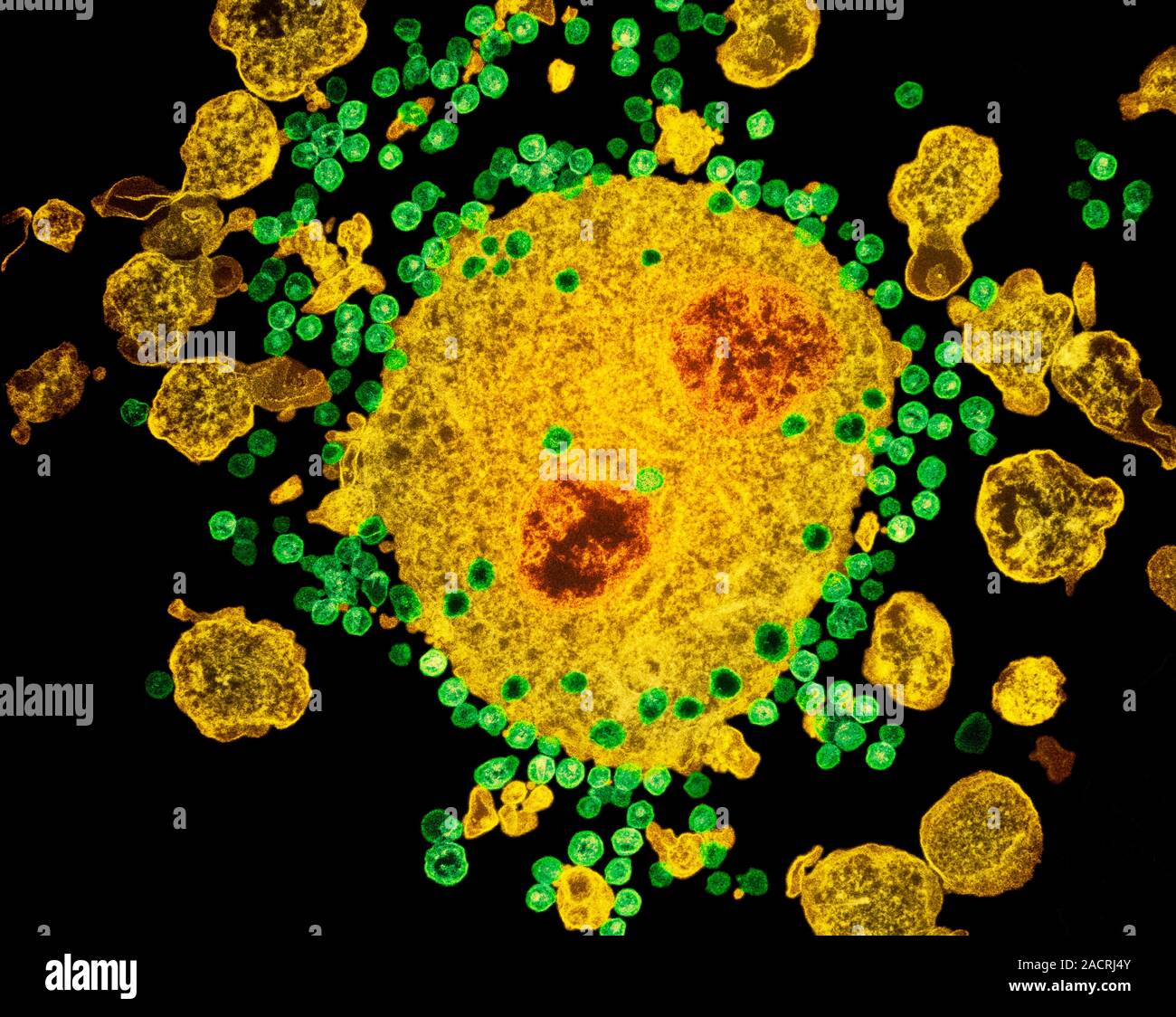 Budding HIV particles. Coloured transmision electron micrograph (TEM ...