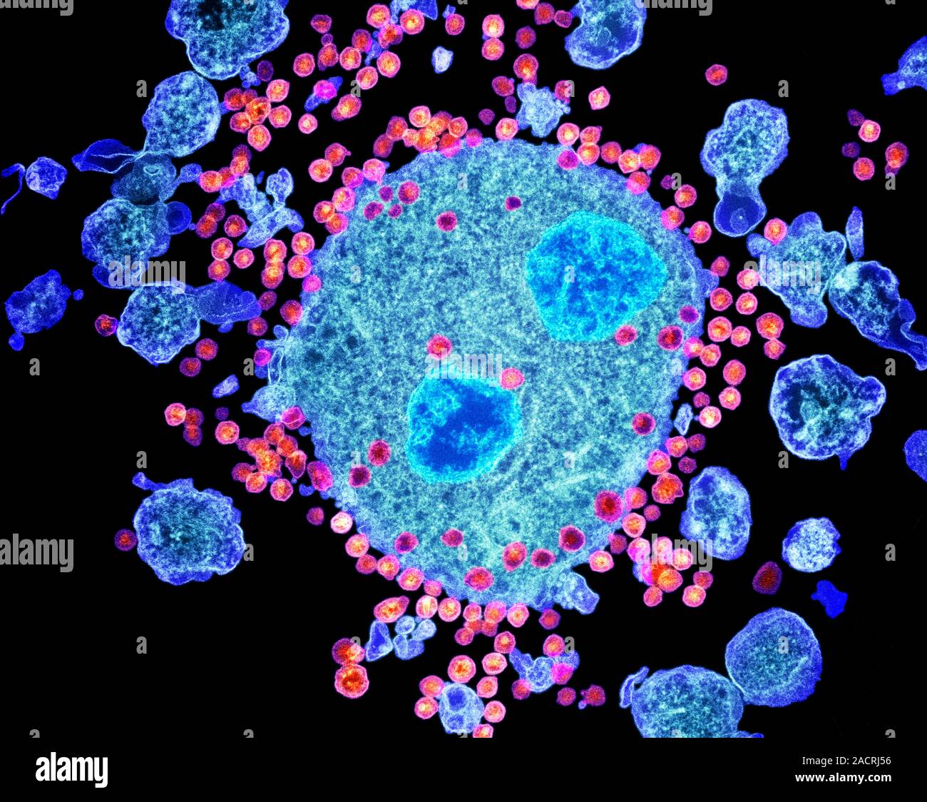 Budding HIV particles. Coloured transmision electron micrograph (TEM ...