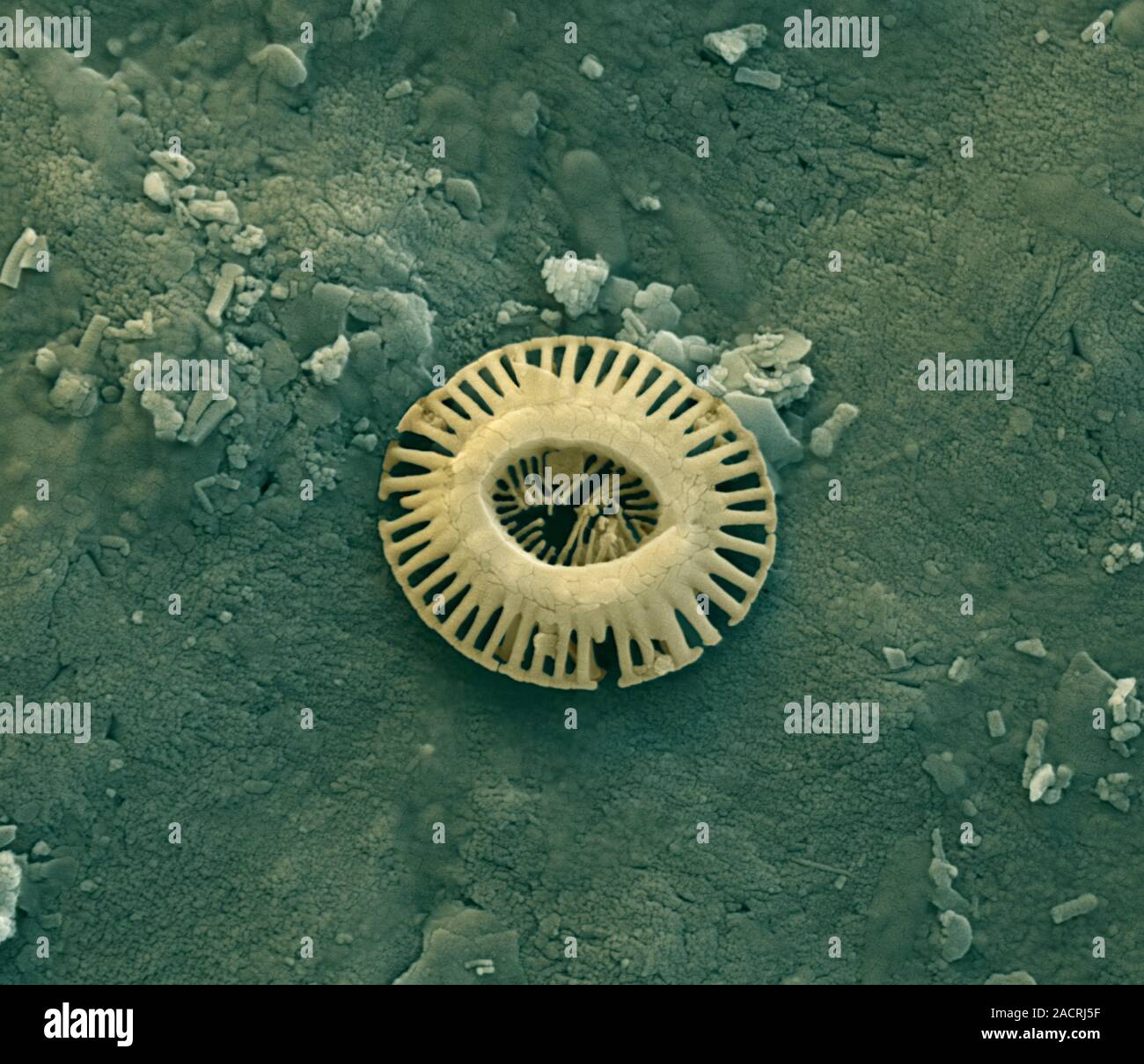 Diatom, coloured scanning electron micrograph (SEM). The diatoms are a ...