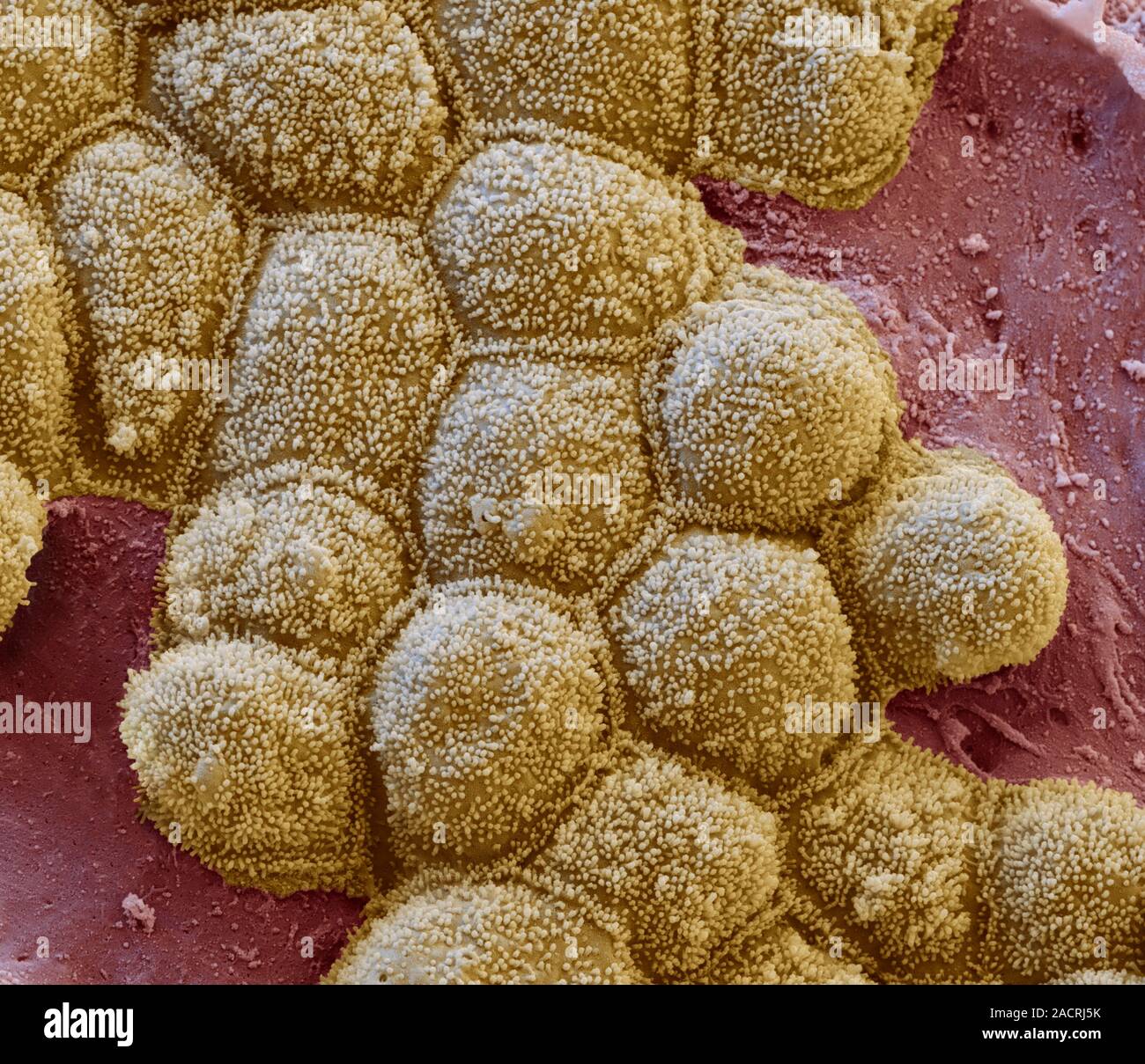 Lung lining. Coloured scanning electron micrograph (SEM) of the ...