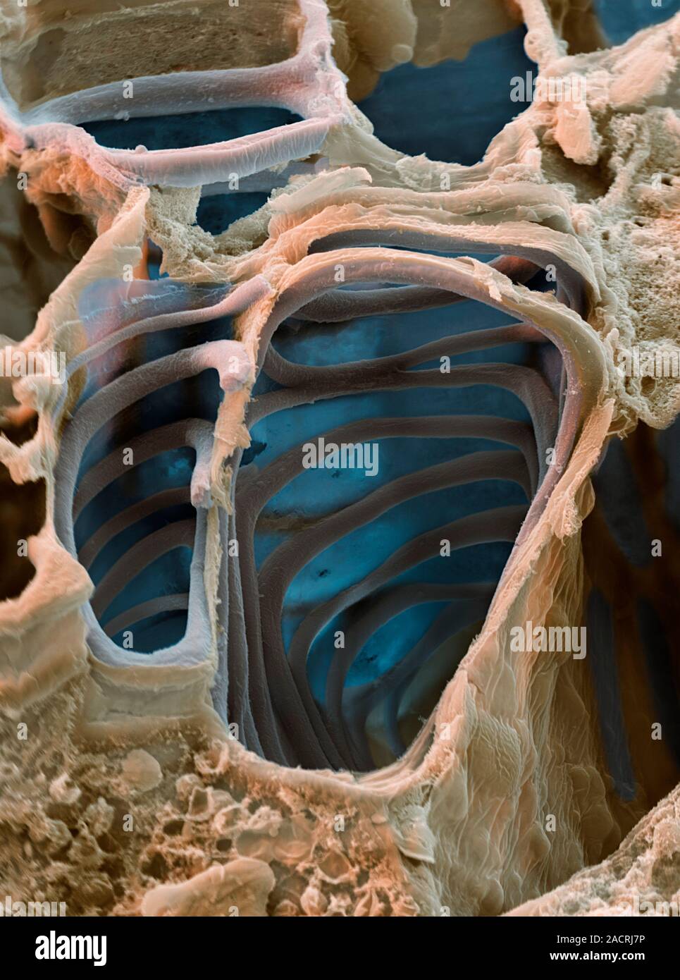Xylem plant cells. Coloured scanning electron micrograph (SEM) of xylem ...