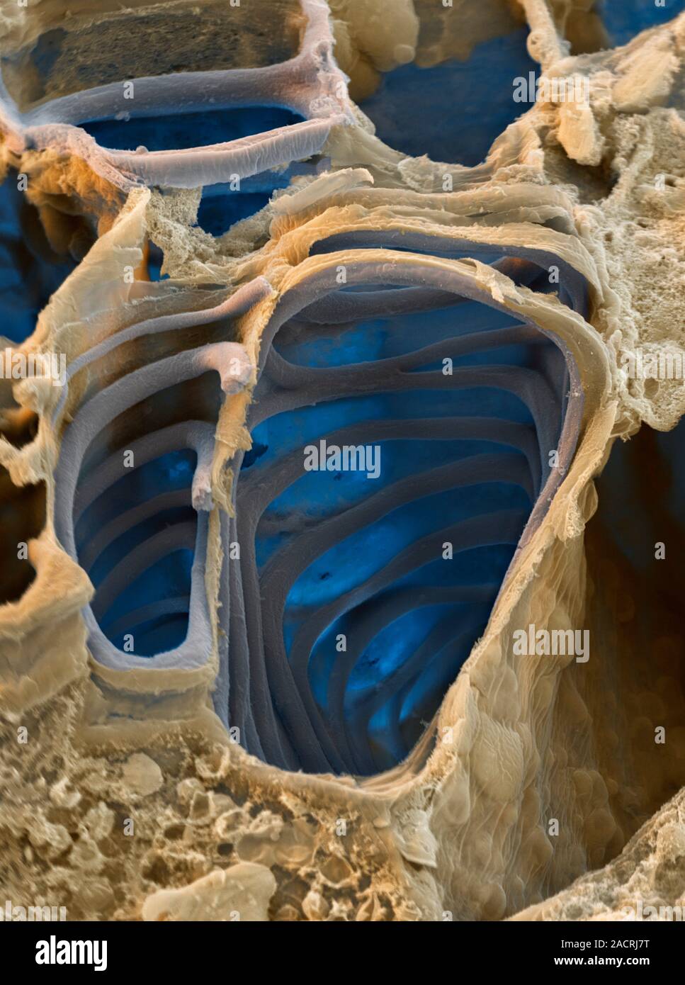 Xylem plant cells. Coloured scanning electron micrograph (SEM) of xylem ...