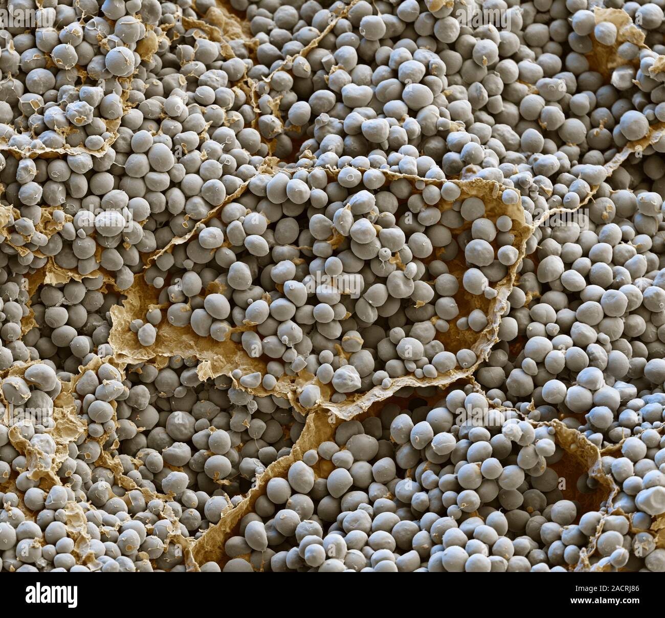 Maize (Zea mays) grain, coloured scanning electron micrograph (SEM ...
