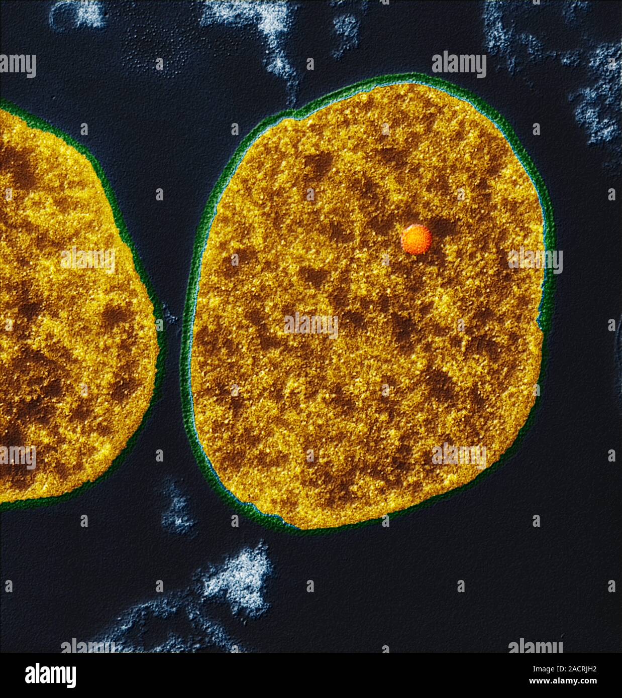 Sulfolobus archaea. Coloured transmission electron micrograph (TEM) of ...