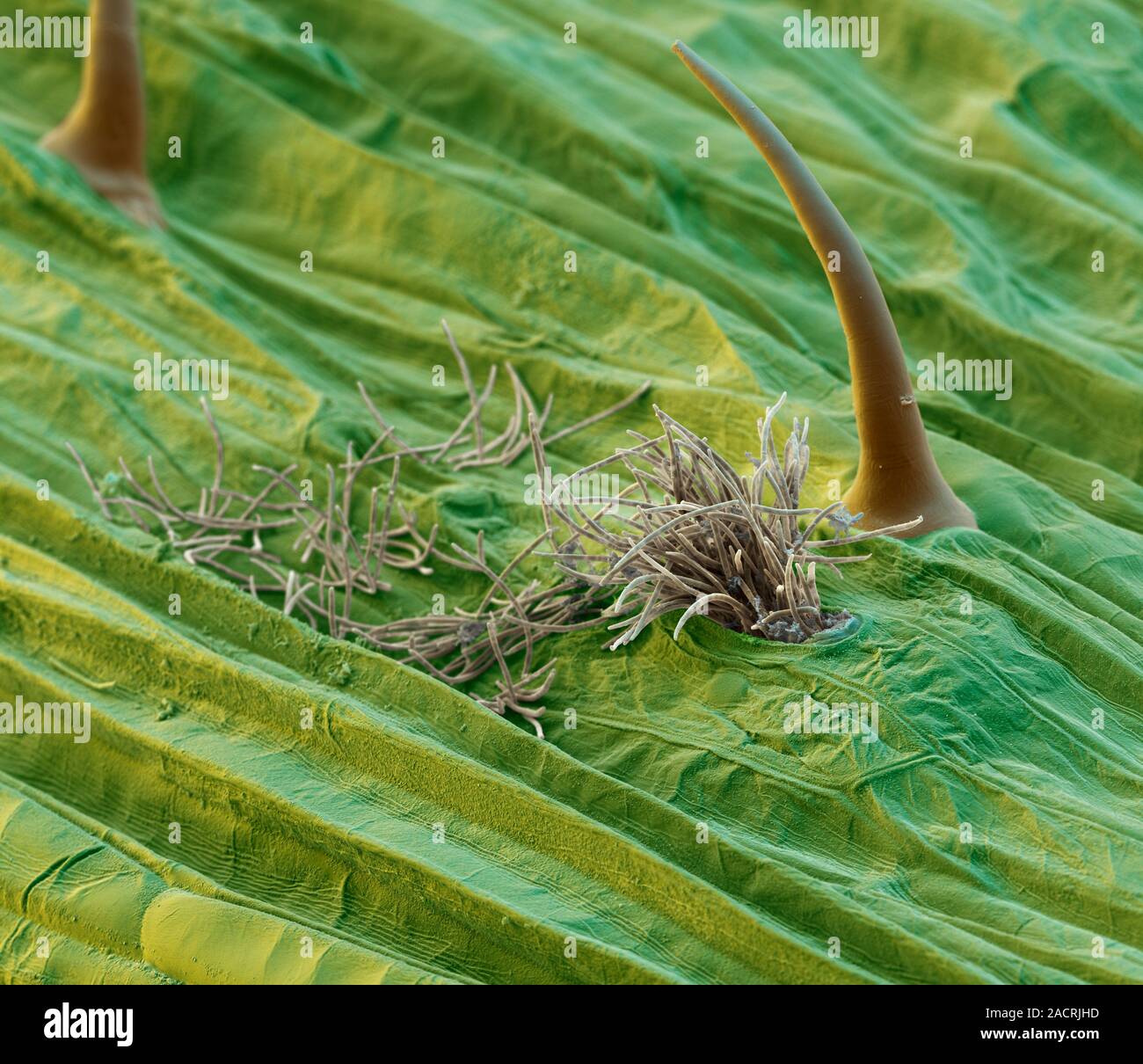 Septoria leaf blotch infection. Coloured scanning electron micrograph ...