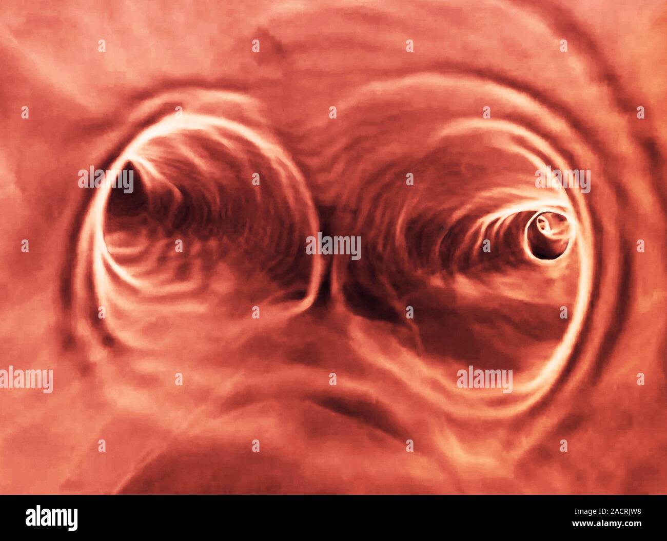 Trachea. Coloured 3D computed tomography (CT) scan of the healthy ...