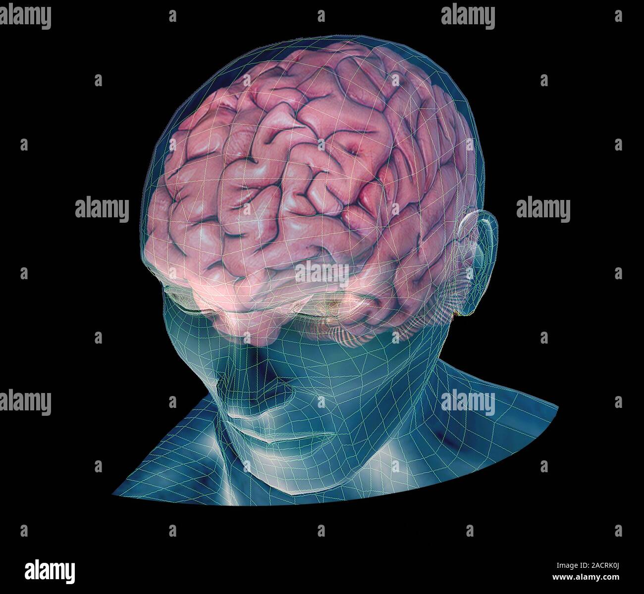 Healthy brain, 3D magnetic resonance imaging (MRI) scan and wire-frame ...